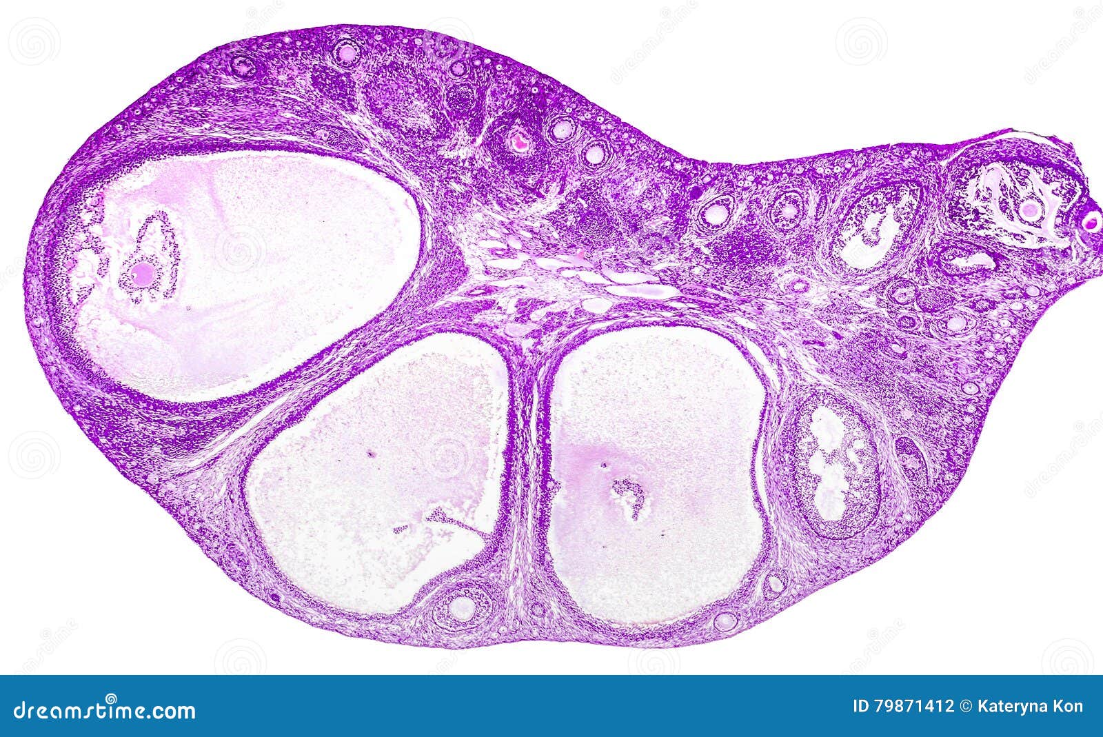 Light micrograph of ovary stock photo. Image of ovarian - 79871412 Light micrograph of ovary stock photo. Image of ovarian - 79871412