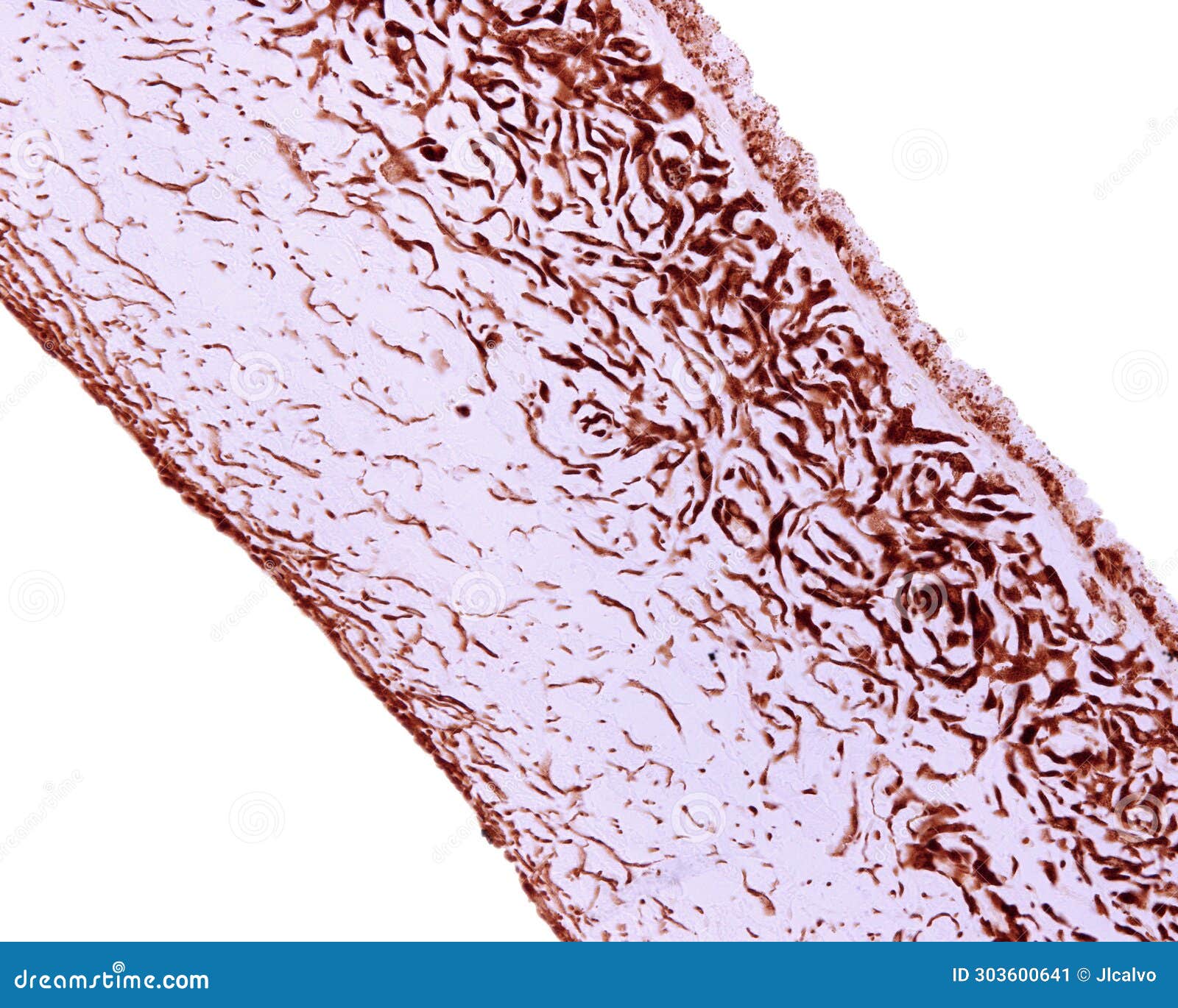 Iris melanin stock image. Image of microscope, epithelium - 303600641