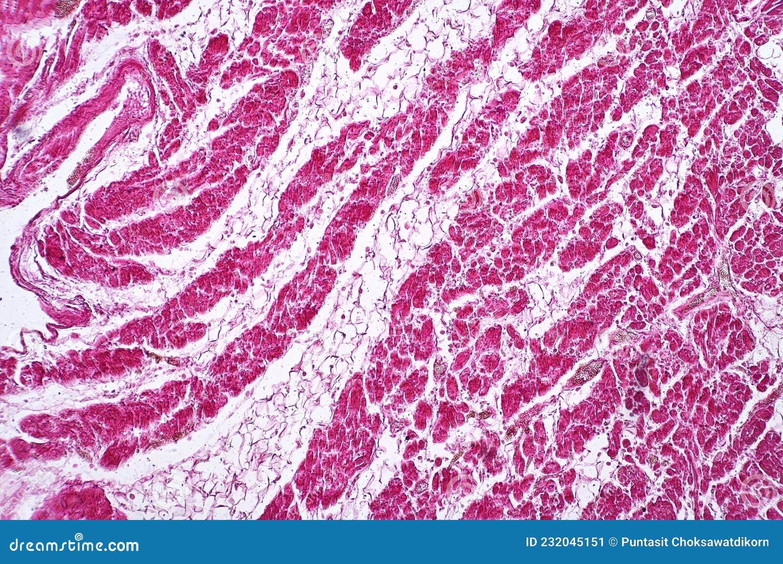 Light Microscope Adiposis of Heart Pathplogy Stock Image - Image of ...