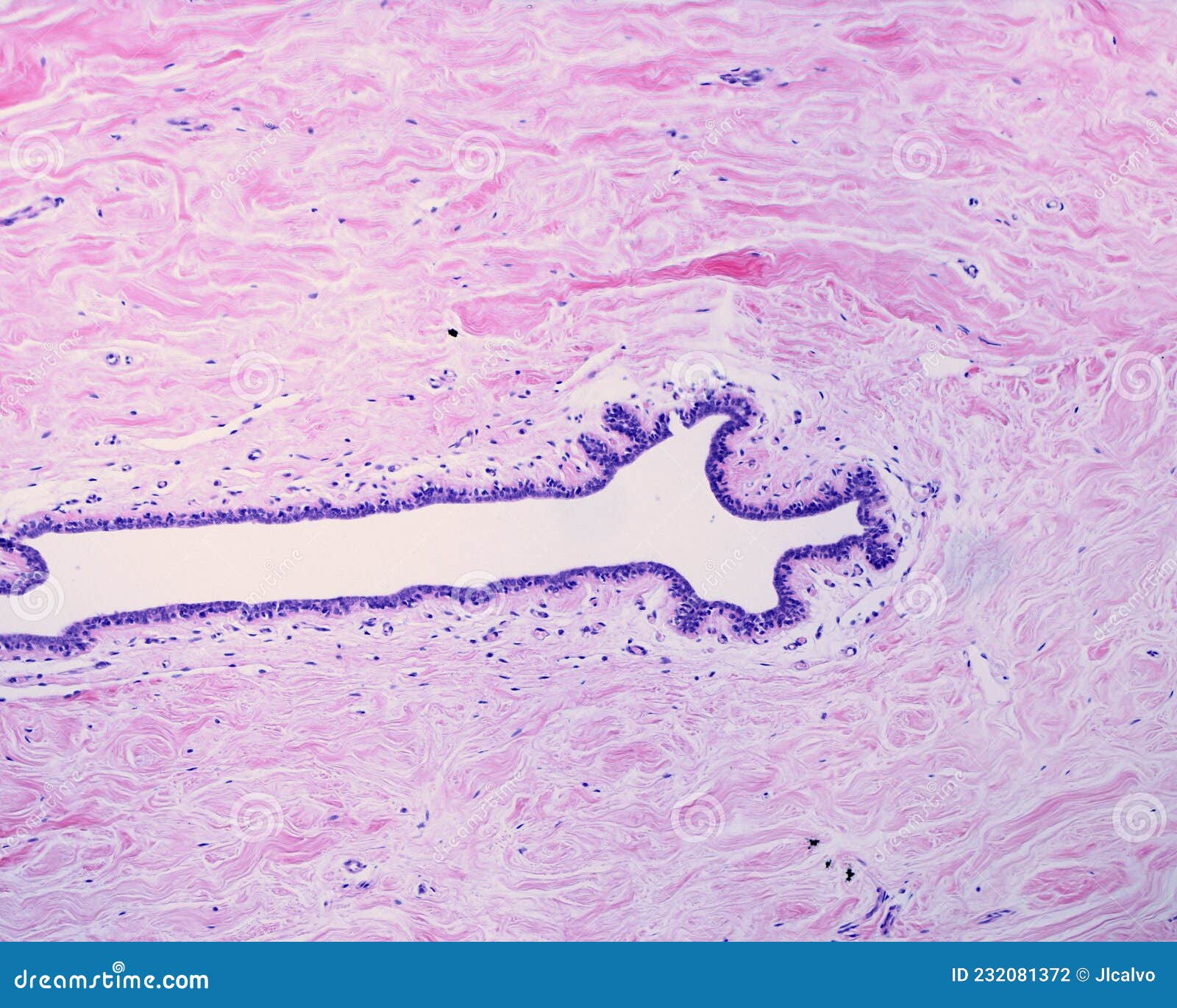 Human Breast Gland. Lactiferous Duct Stock Photo - Image of gland ...