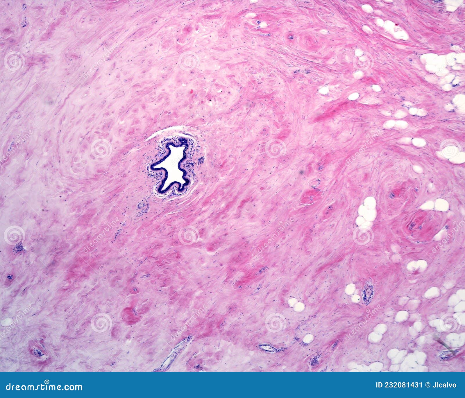 Human Breast Gland. Lactiferous Duct Stock Image - Image of mammary ...