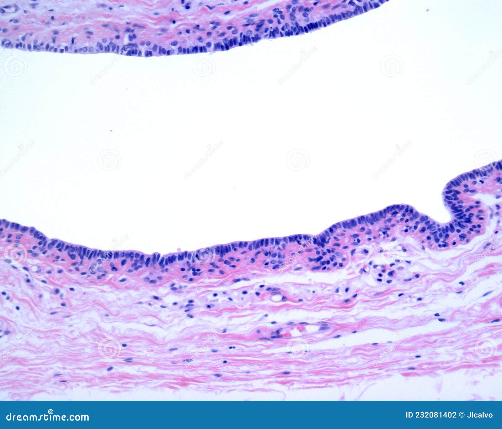 Human Breast Gland. Lactiferous Duct Stock Photo - Image of ...