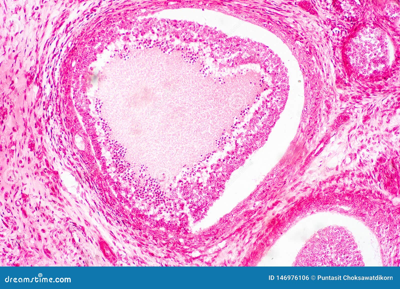 Ovary. Primary Follicle Royalty-Free Stock Photography | CartoonDealer ... Ovary. Primary Follicle Royalty-Free Stock Photography | CartoonDealer ...