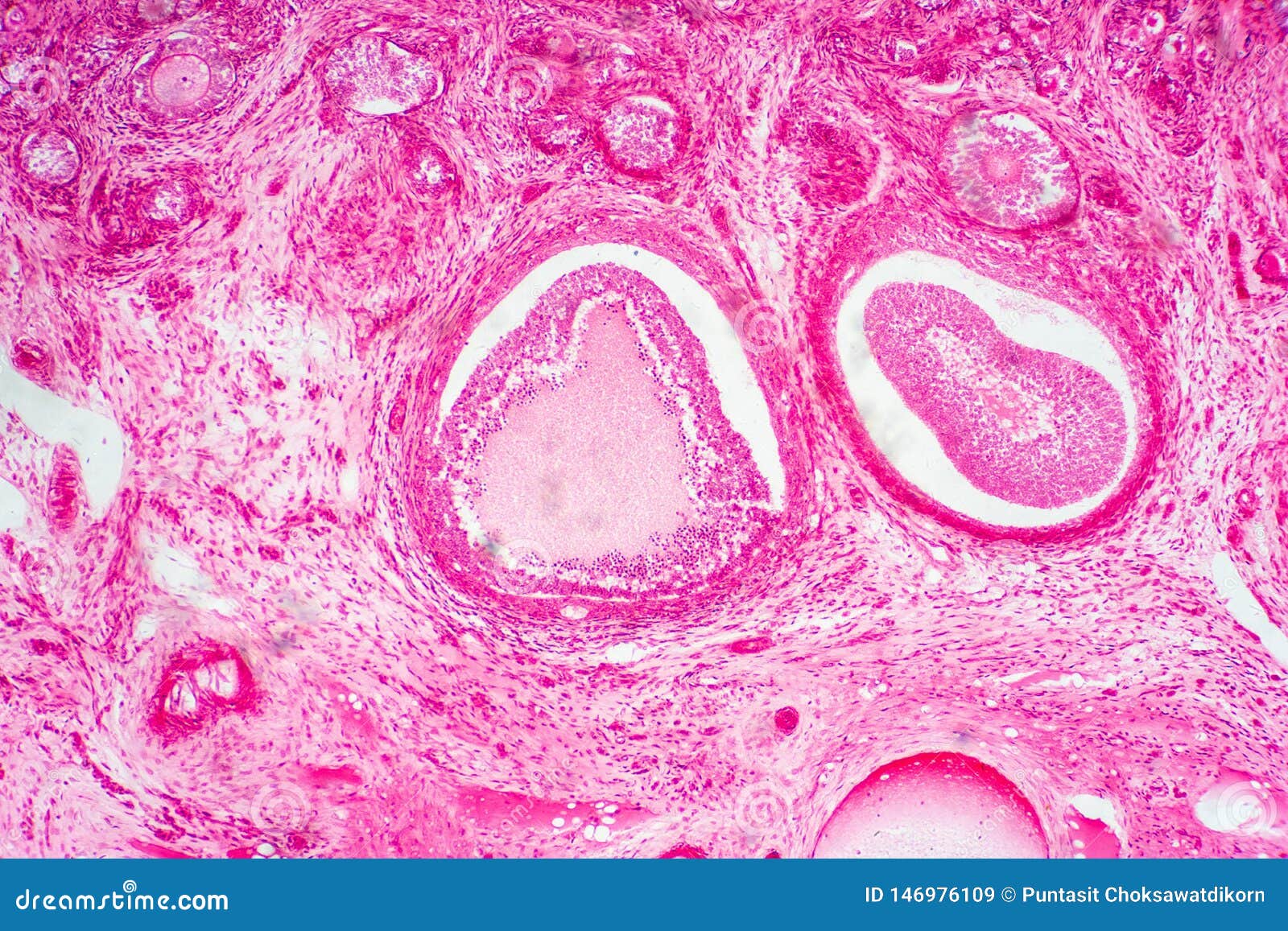 Light Microscopic of Human Ovary Showing Primary and Secondary ... Light Microscopic of Human Ovary Showing Primary and Secondary ...