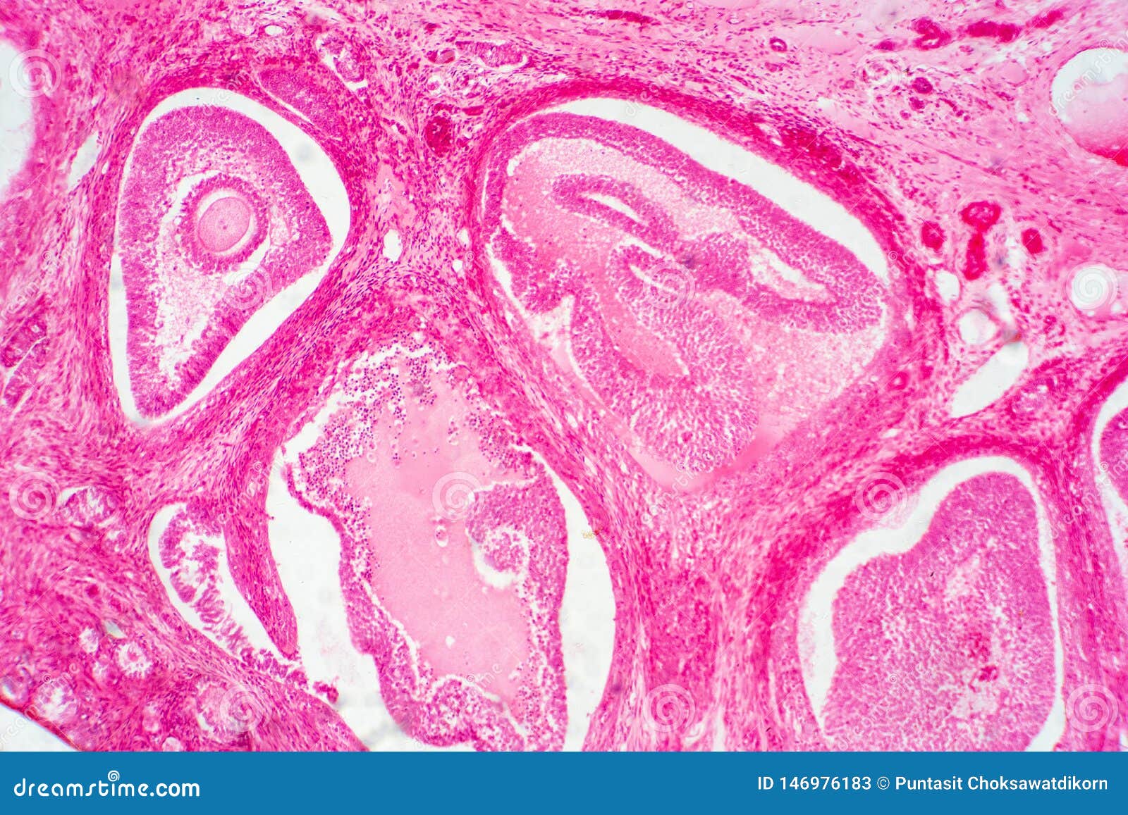 Ovary. Primary Follicle Royalty-Free Stock Photography | CartoonDealer ... Ovary. Primary Follicle Royalty-Free Stock Photography | CartoonDealer ...