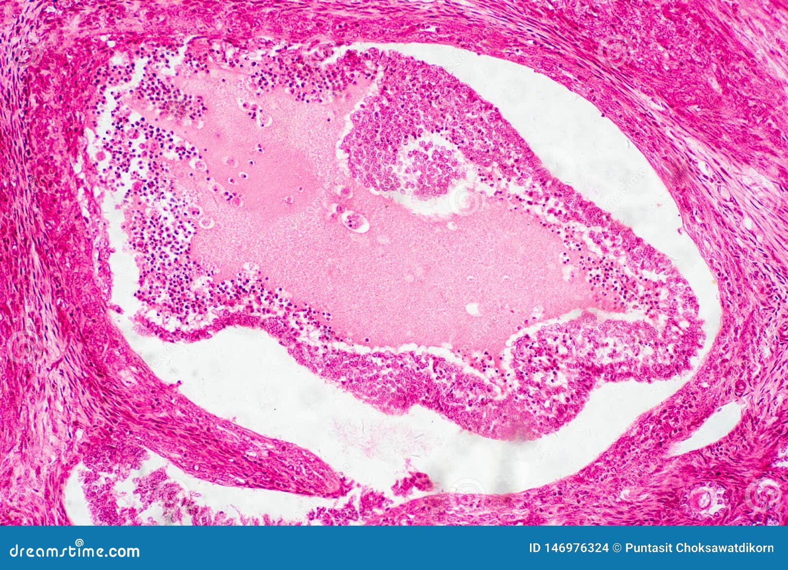 Ovary. Primary Follicle Royalty-Free Stock Photography | CartoonDealer ... Ovary. Primary Follicle Royalty-Free Stock Photography | CartoonDealer ...
