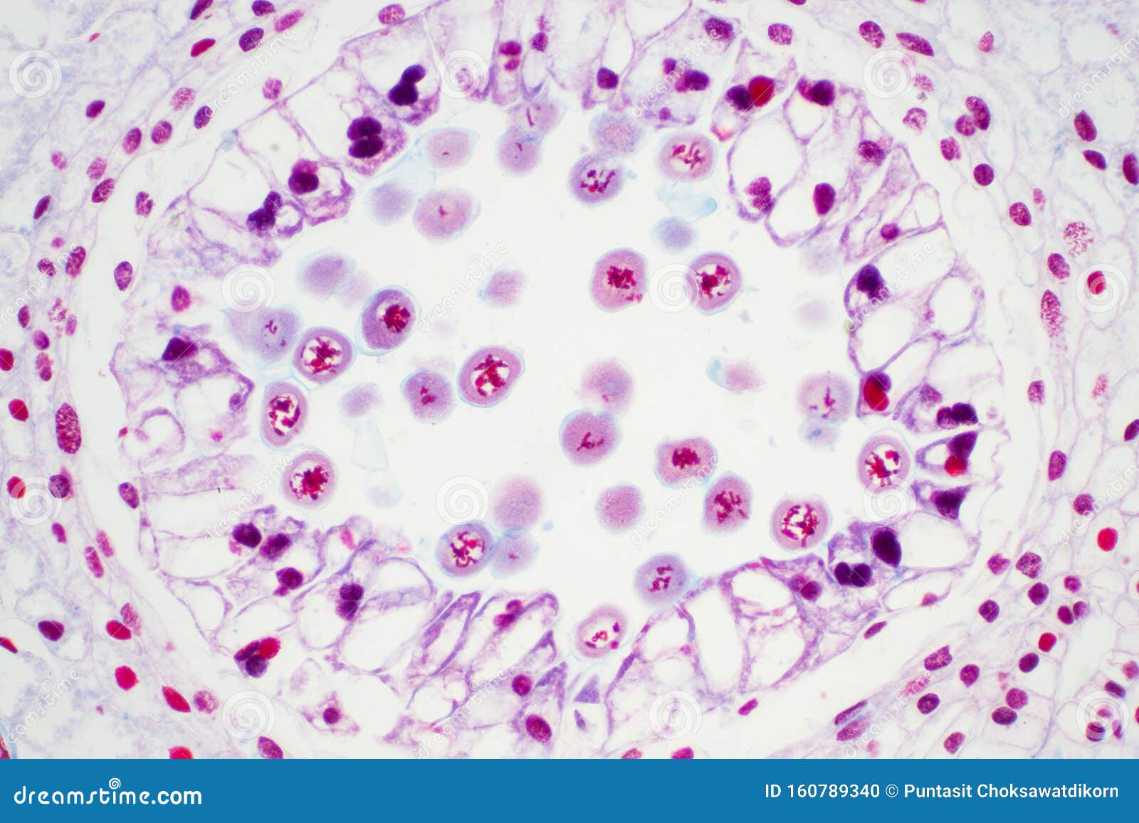 Anther Cross Section