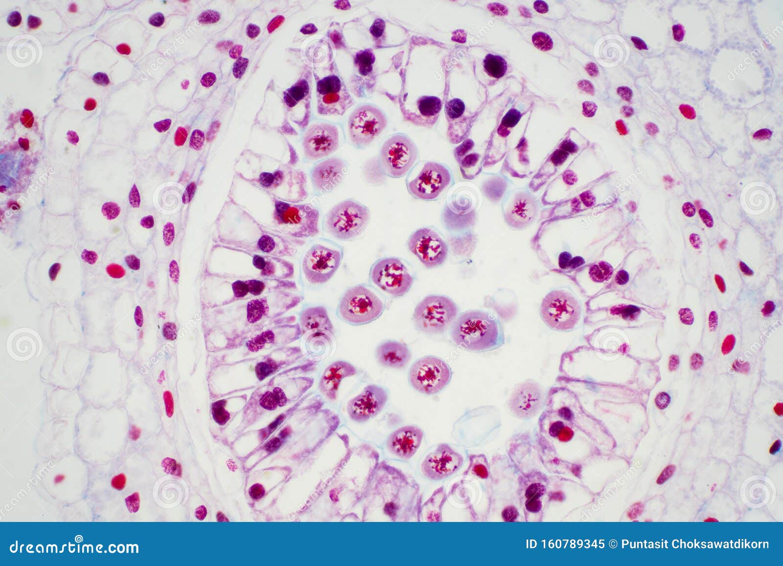 Lily Anther Cross Section Seen through Microscope for Education Stock ...