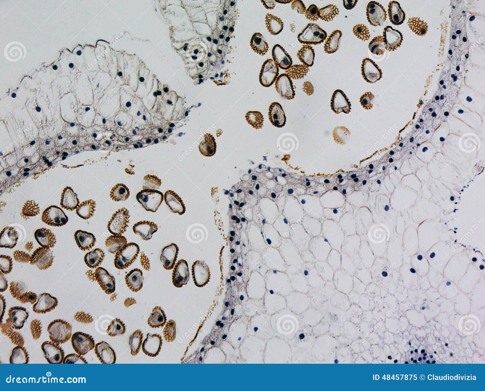 Lily Anther Micrograph Royalty-Free Stock Photography | CartoonDealer ...