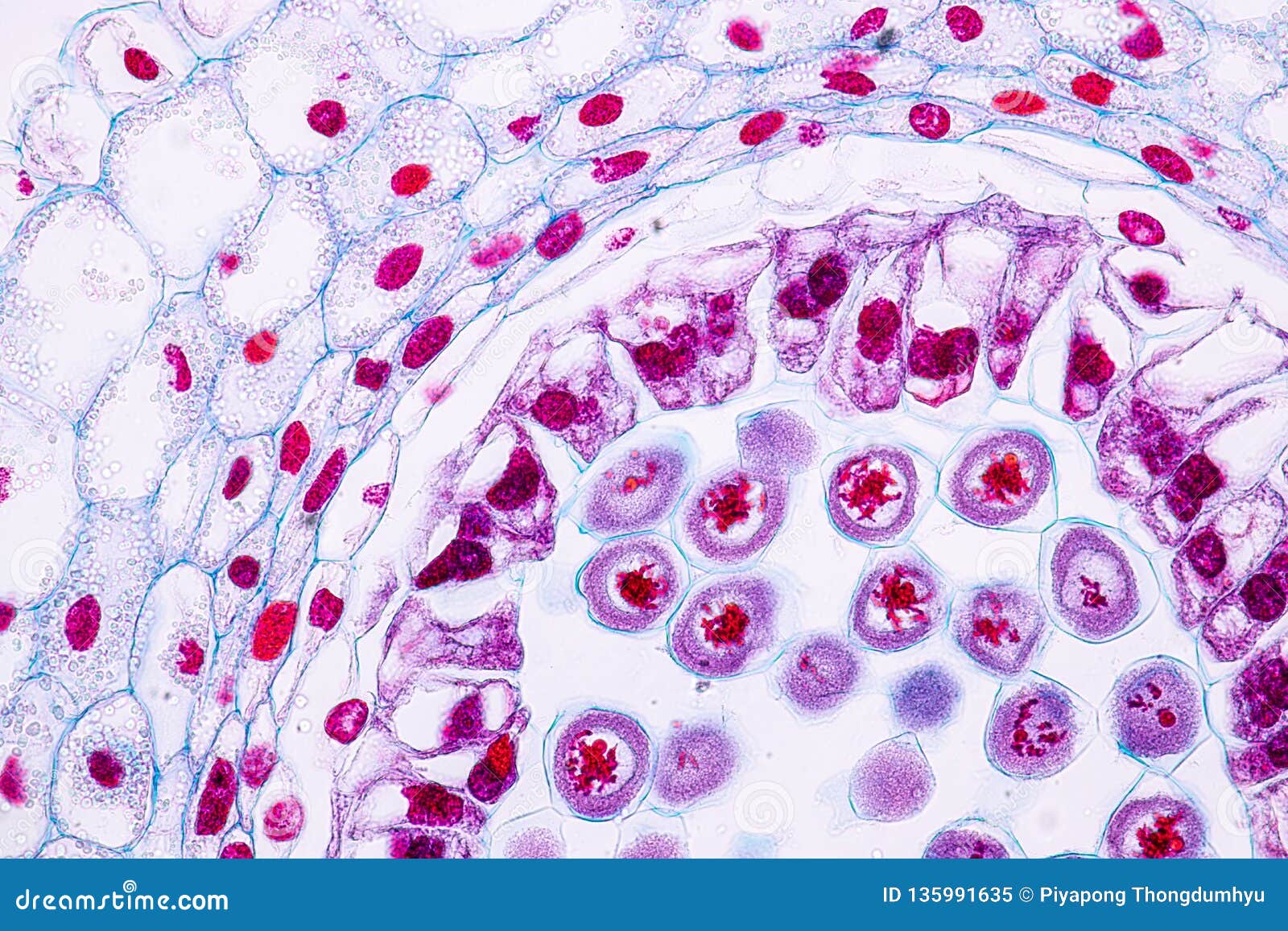 Lily Anther Micrograph Royalty-Free Stock Photography | CartoonDealer ... Lily Anther Micrograph Royalty-Free Stock Photography | CartoonDealer ...