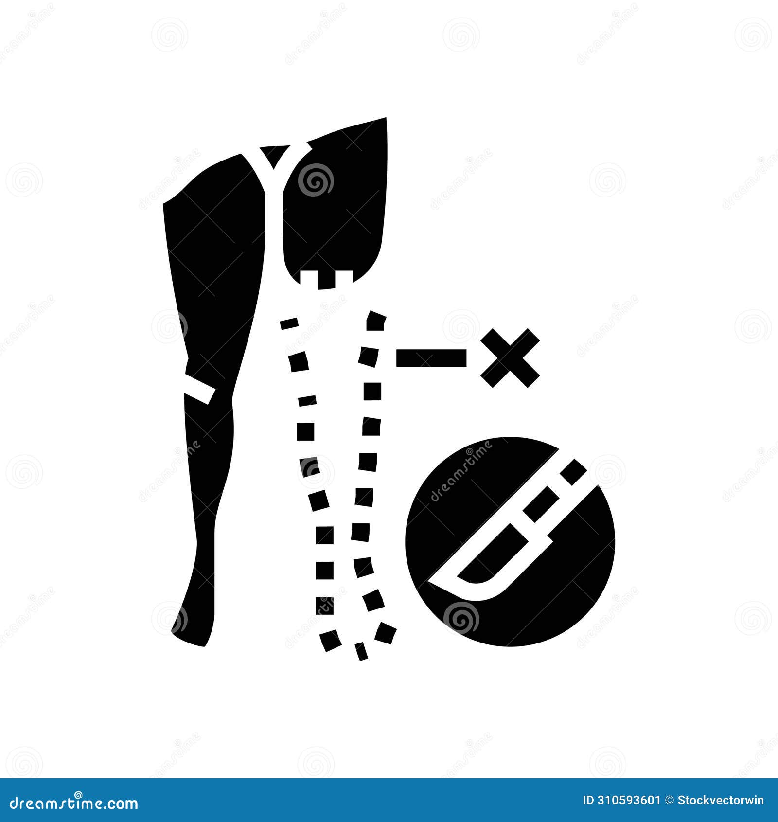Limb Amputation Surgery Glyph Icon Vector Illustration Stock Vector ...