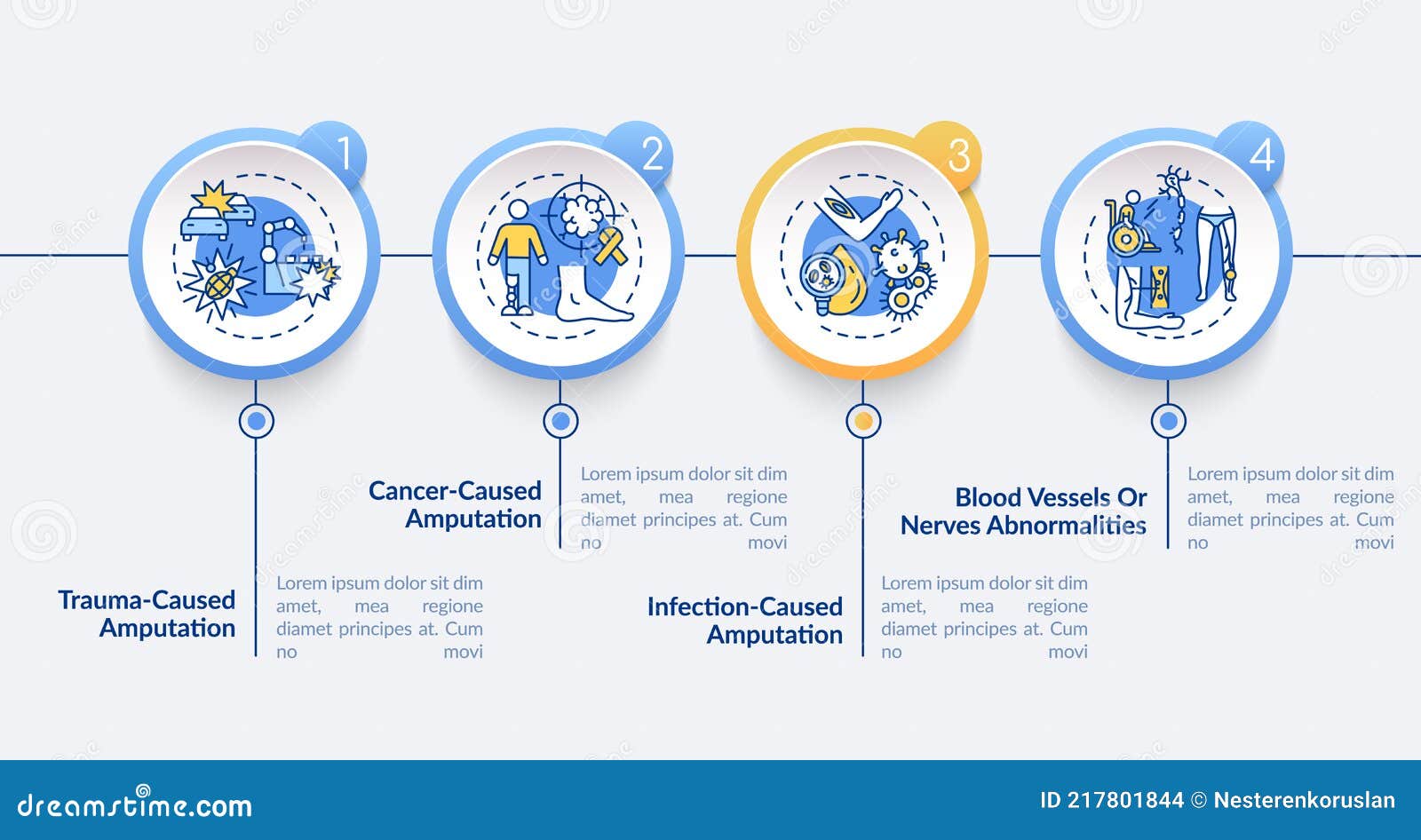 ME Causes Vector Infographic Template | CartoonDealer.com #203691790