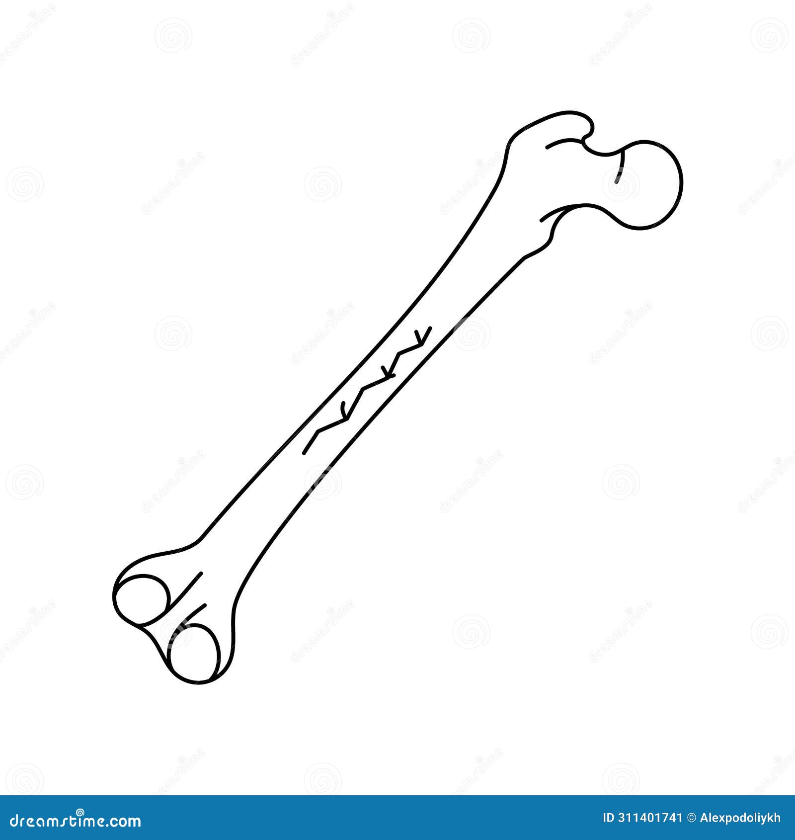 Linear Bone Fracture Line Icon. Stock Vector - Illustration of ...