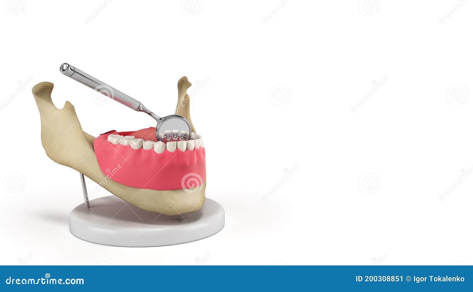 Lingual Braces Logo Sign Vector Outline | CartoonDealer.com #326038843