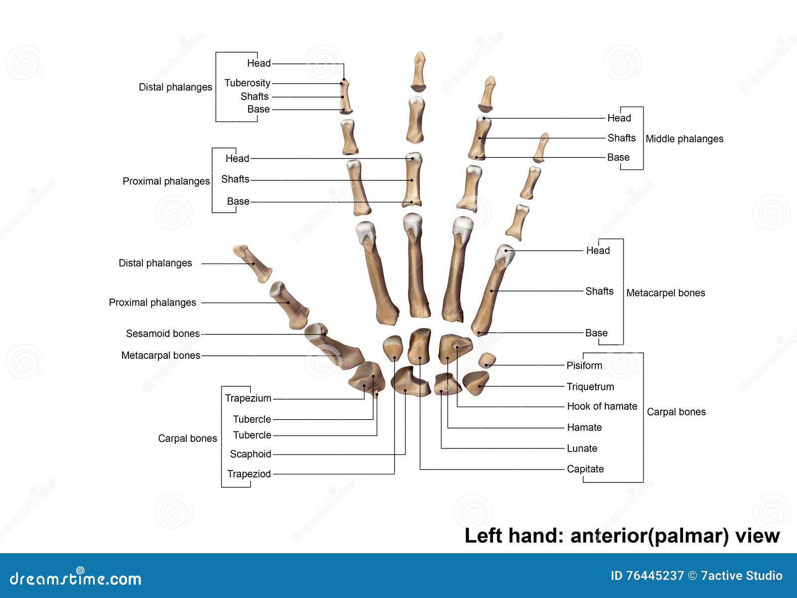 Linkes Hand-anterior& X28; Palmer& X29; Zerstreute Ansicht Stockbild ...