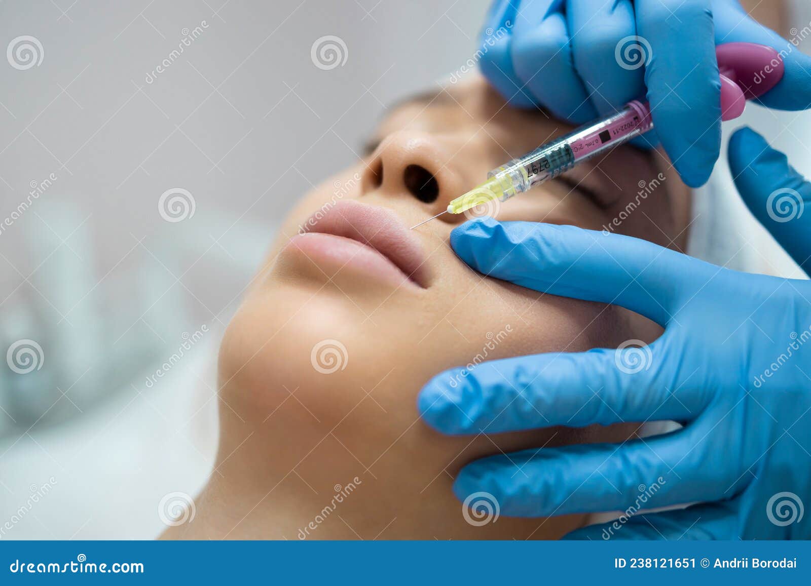 Lip Augmentation And Correction Procedure Close Up Hyaluronic Acid Injection Stock Image
