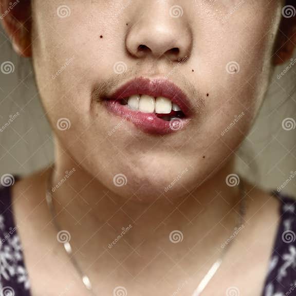 Lip biting stock image. Image of challange, irritated - 23271357