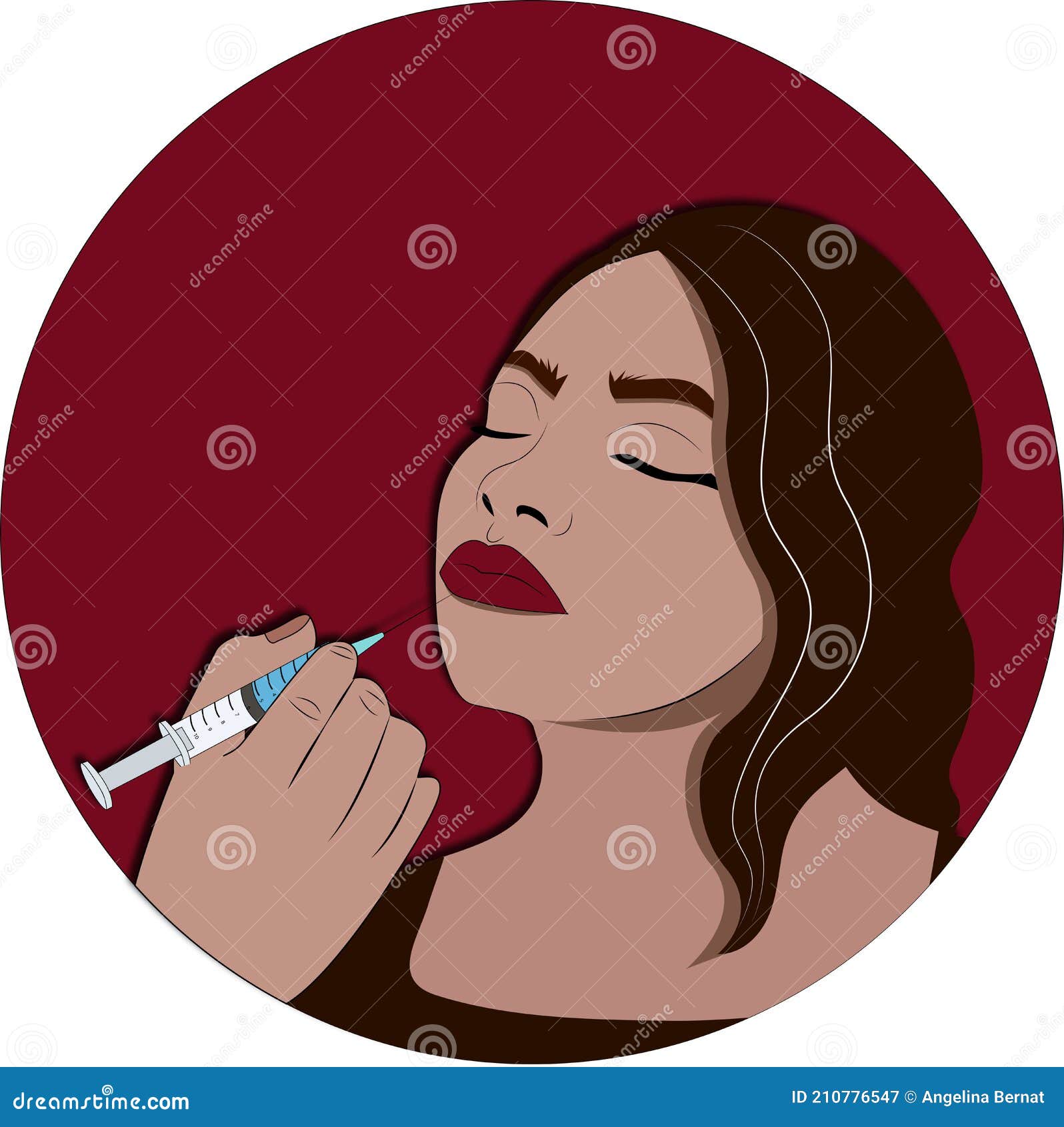 Lips Filler Injections Concept, Vector Illustration. Lip Augmentation ...