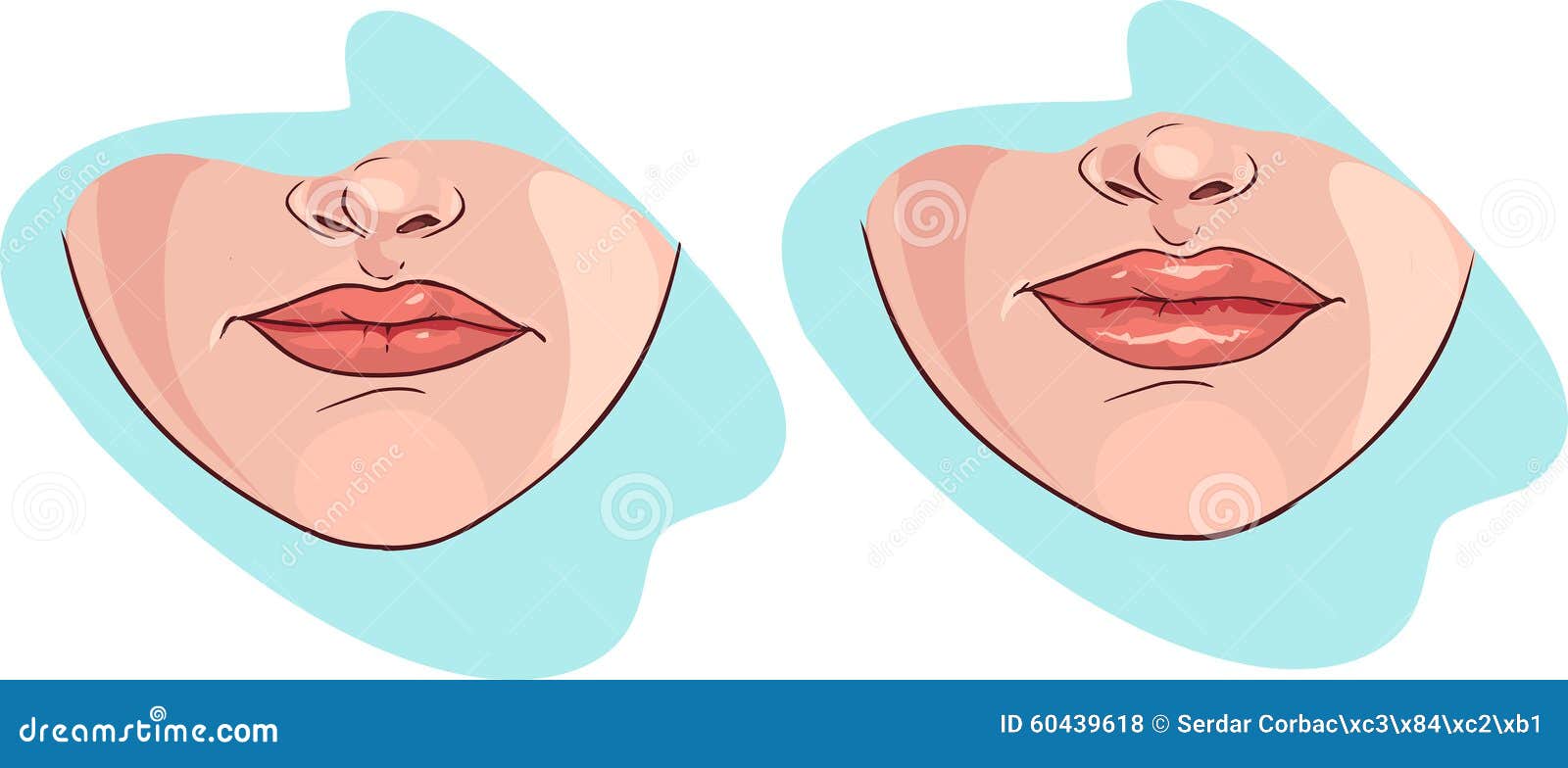 Lip filler stock vector. Illustration of women, filling - 60439618