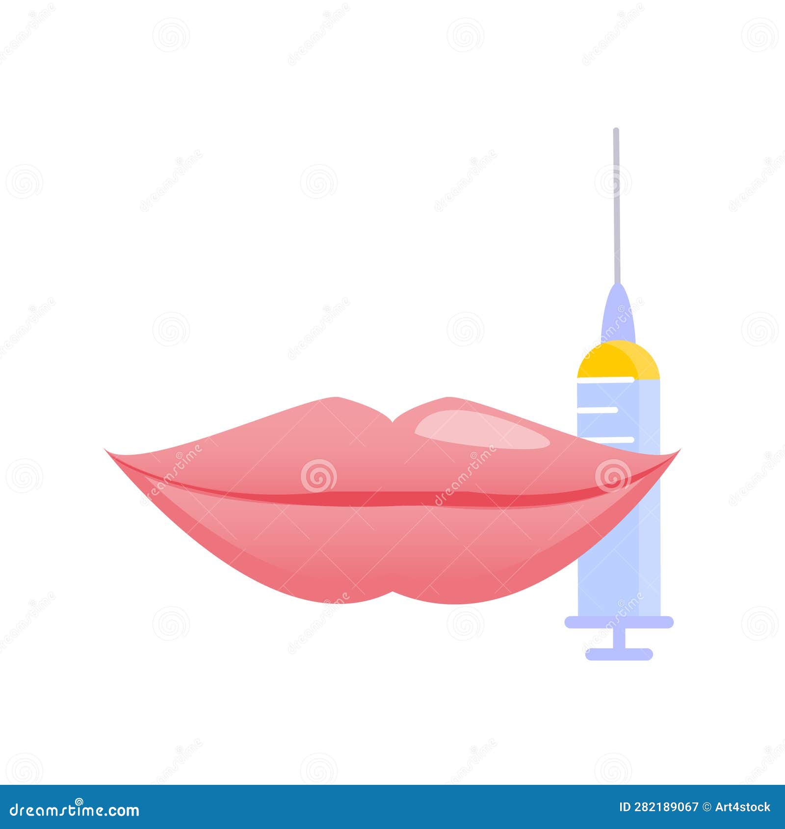Lip Plumping Augmentation with Filler Injection Illustration Stock ... Lip Plumping Augmentation with Filler Injection Illustration Stock ...