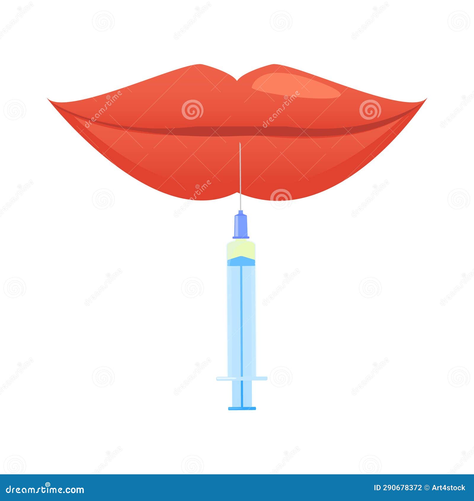 Lip Plumping Augmentation With Filler Injection Illustration Cartoon ... Lip Plumping Augmentation With Filler Injection Illustration Cartoon ...
