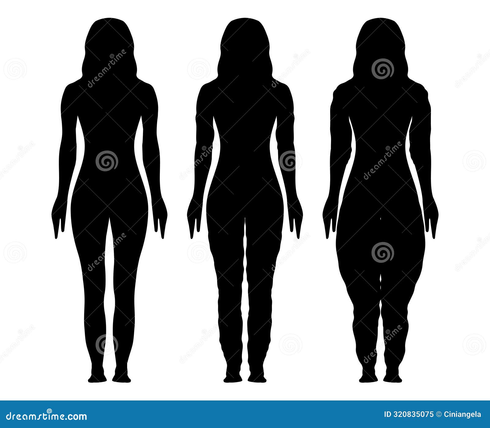 Lipedema Silhouette Illustration with Woman with Normal and Lipedema ...
