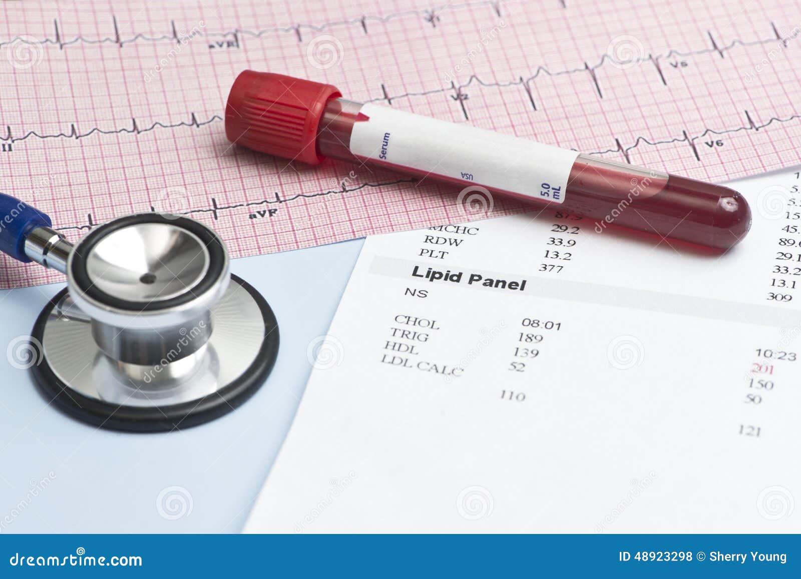 Lipid Panel EKG stock photo. Image of hospital, electrocardiogram ...