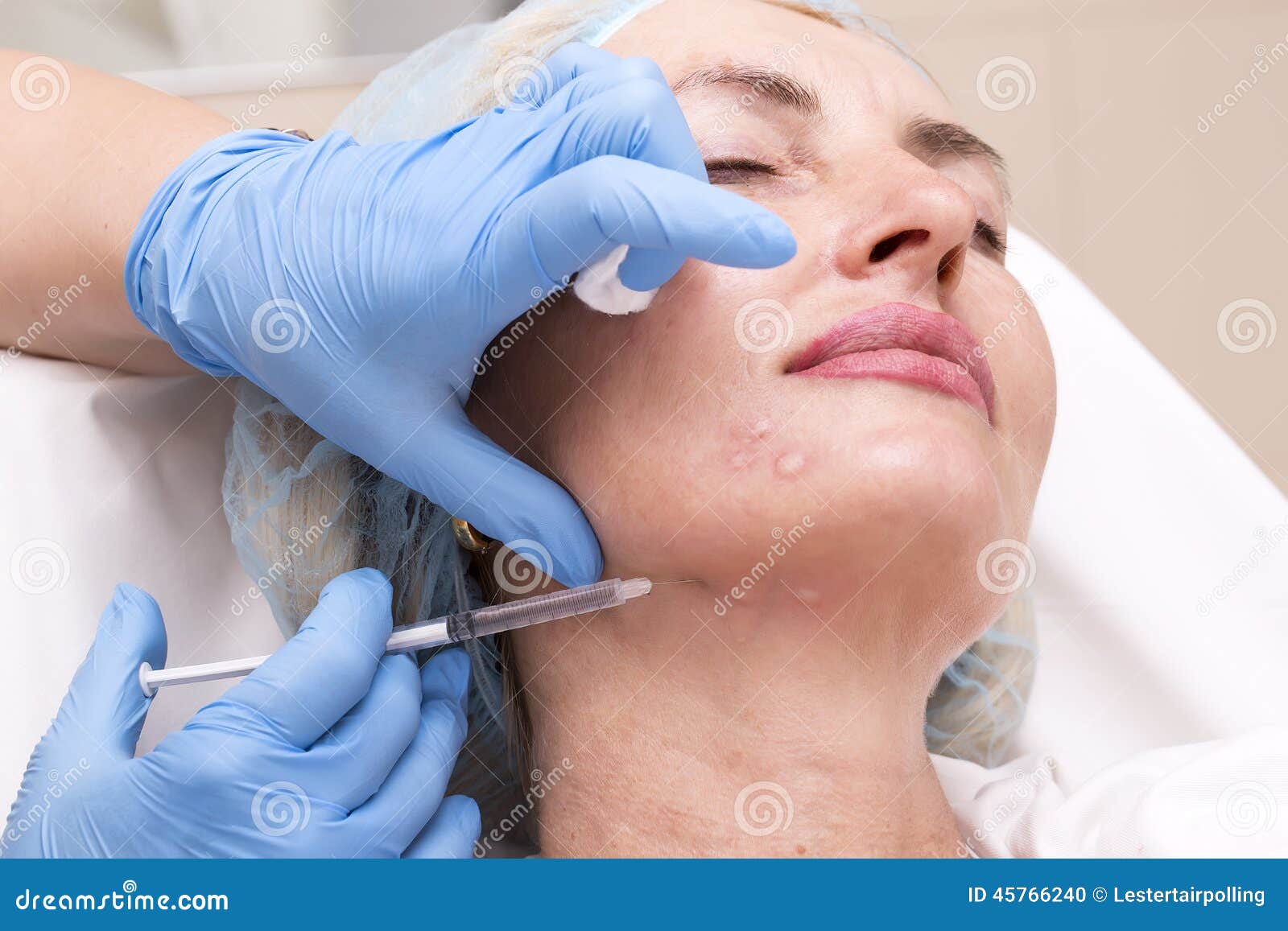 Lipomassage photo stock. Image of soin, cellulite, reprise - 45766240