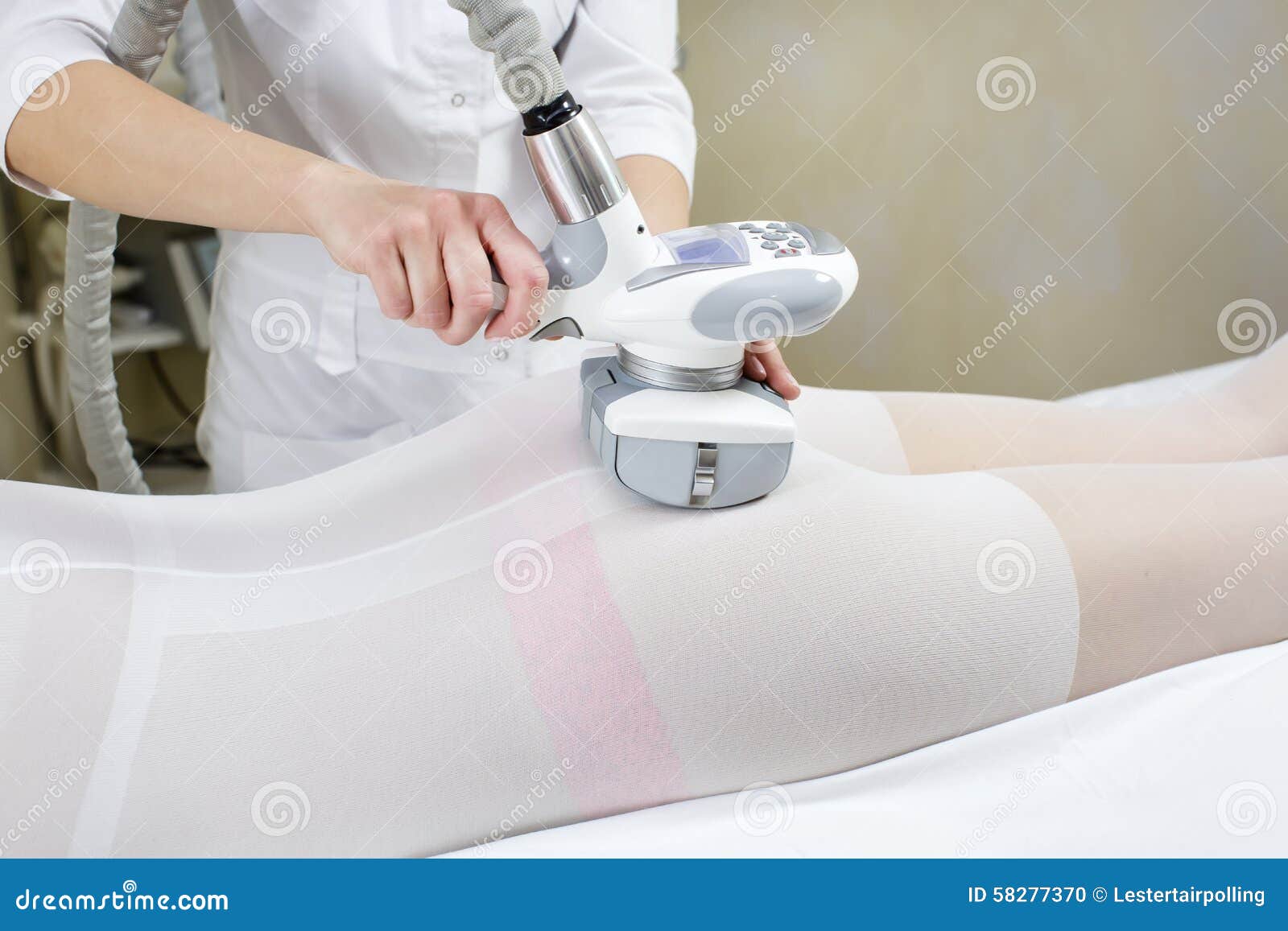 Lipomassage stock photo. Image of endermology, equipment - 58277370