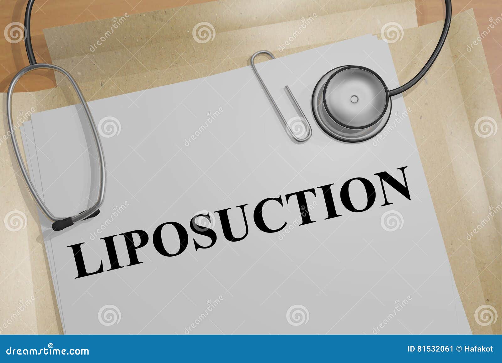Liposuction - Medical Concept Stock Illustration - Illustration of ...