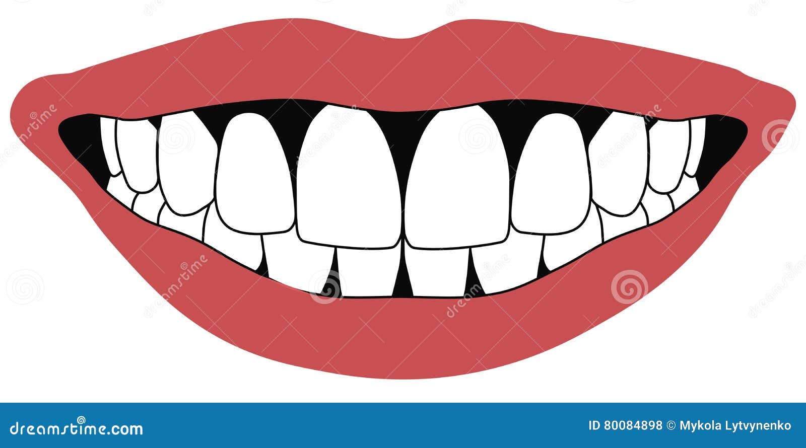 Lips Front Teeth Open Mouth White Front Teeth Dentistry Concept Stock ...