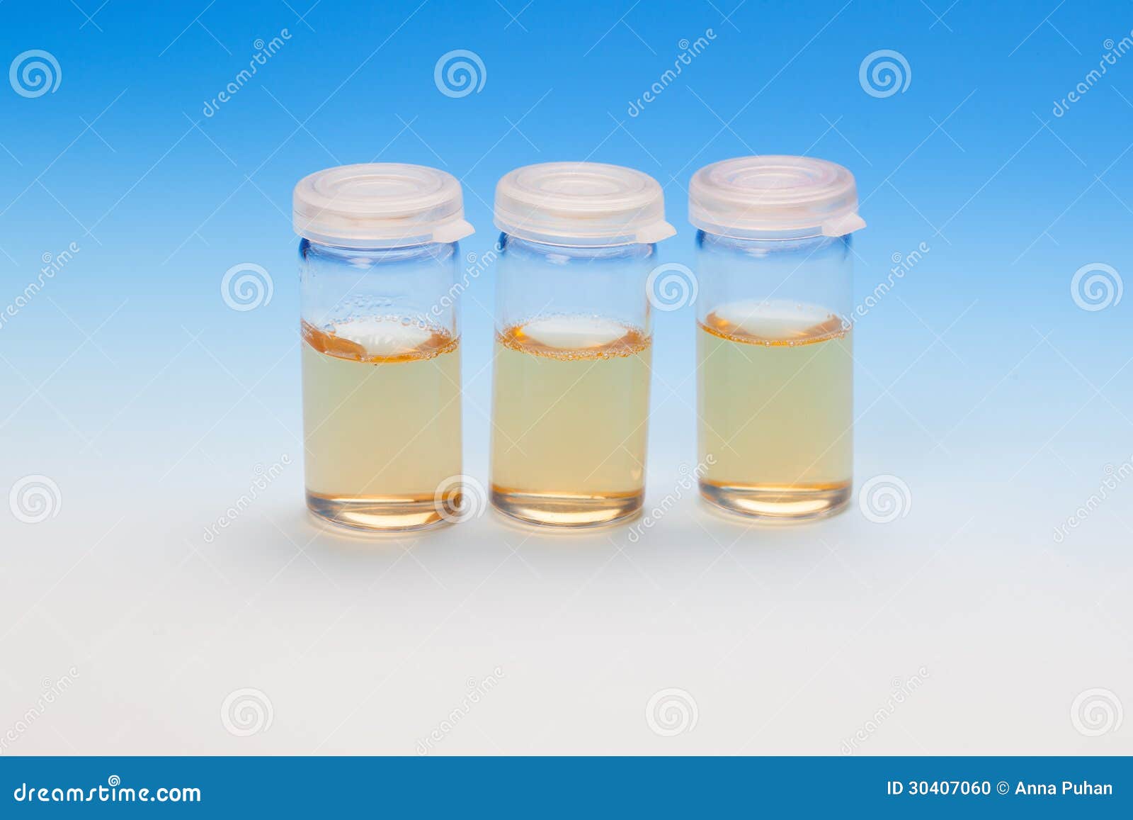 Liquid Samples in Plastic Vials Stock Photo - Image of culture ...