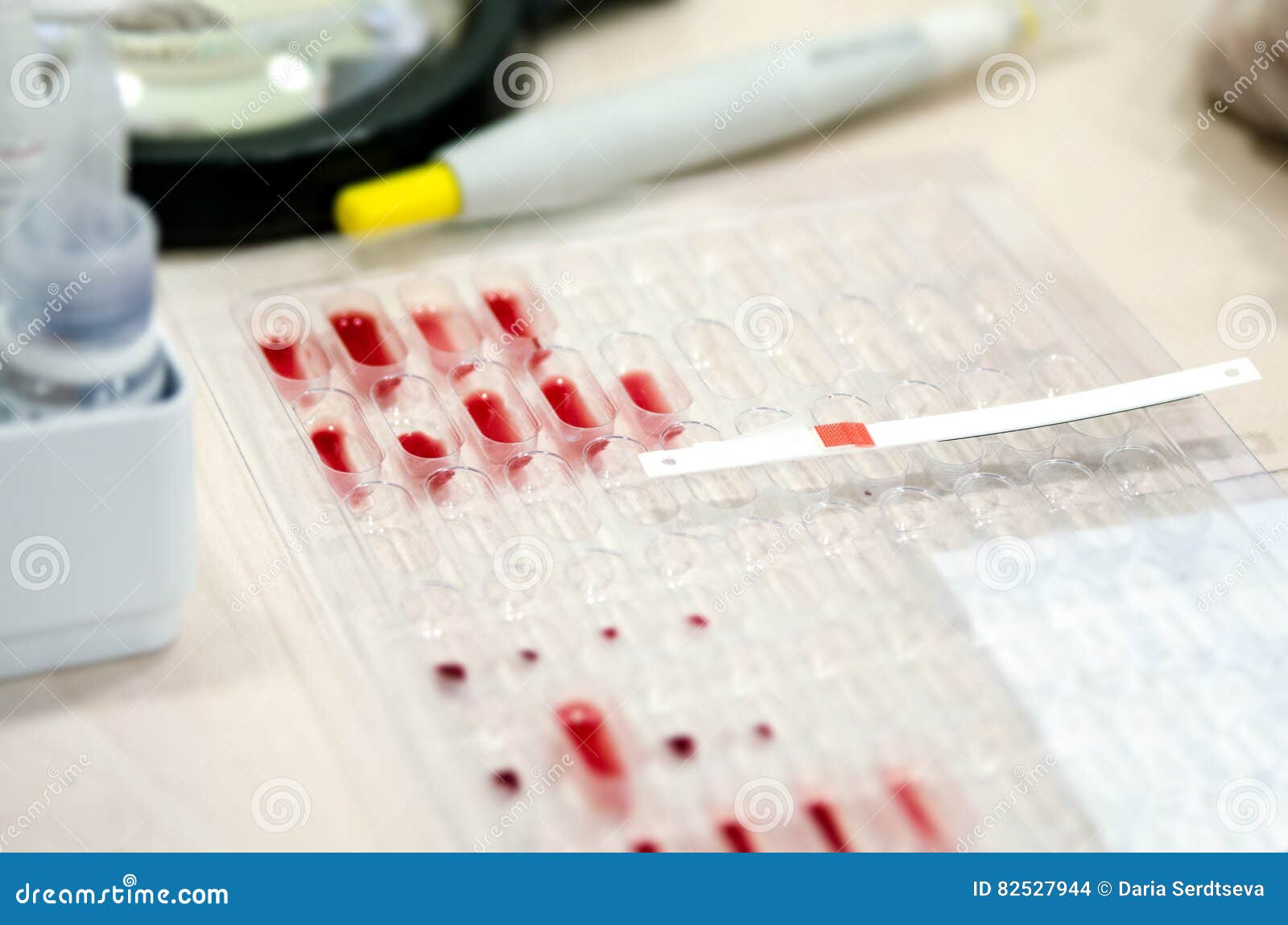 Litmus Strip on Pallets with the Blood To Determine the Rh Factor ...