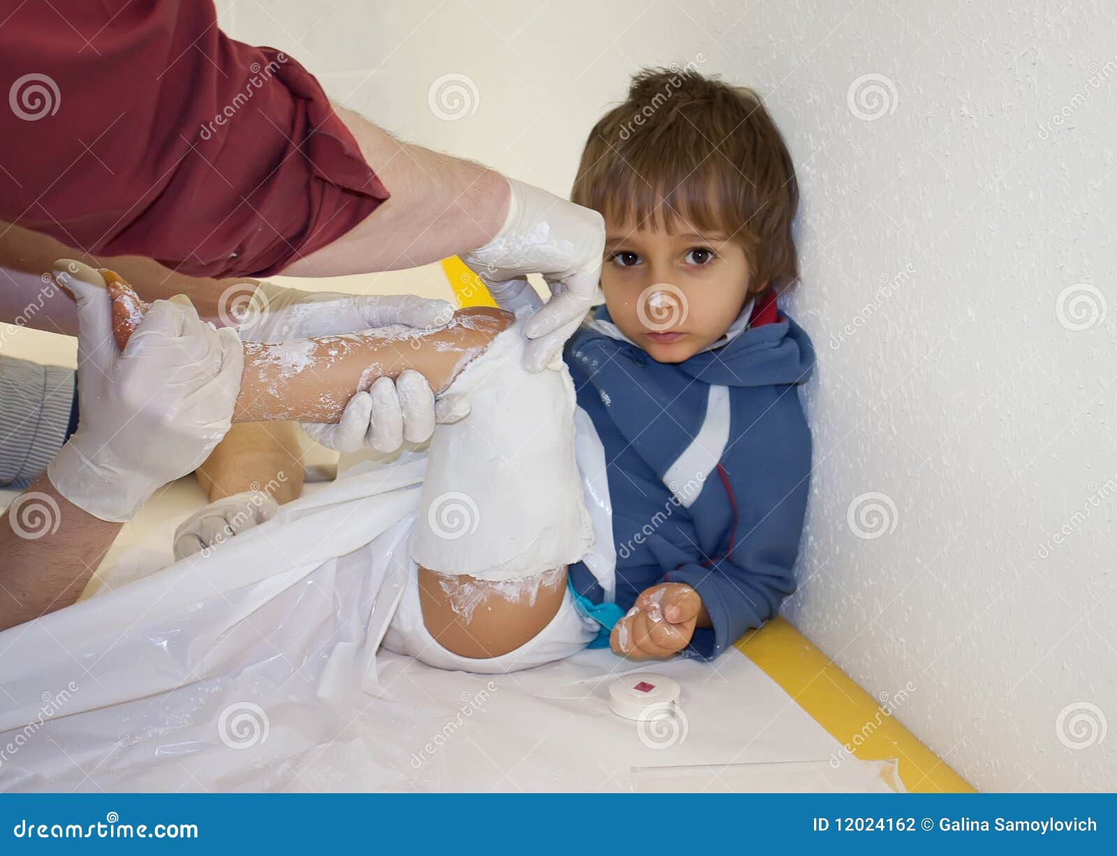 Osteoclasia Stock Photos - Free & Royalty-Free Stock Photos from Dreamstime