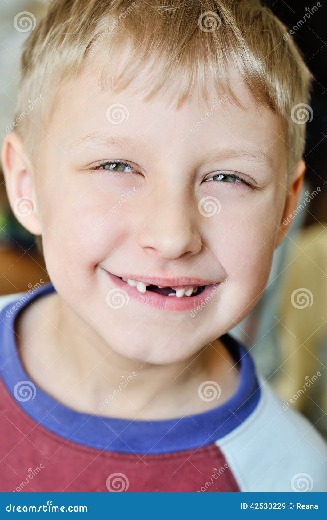 Lost Milk Tooth Boy, New Teeth Coming Royalty-Free Stock Photography ...