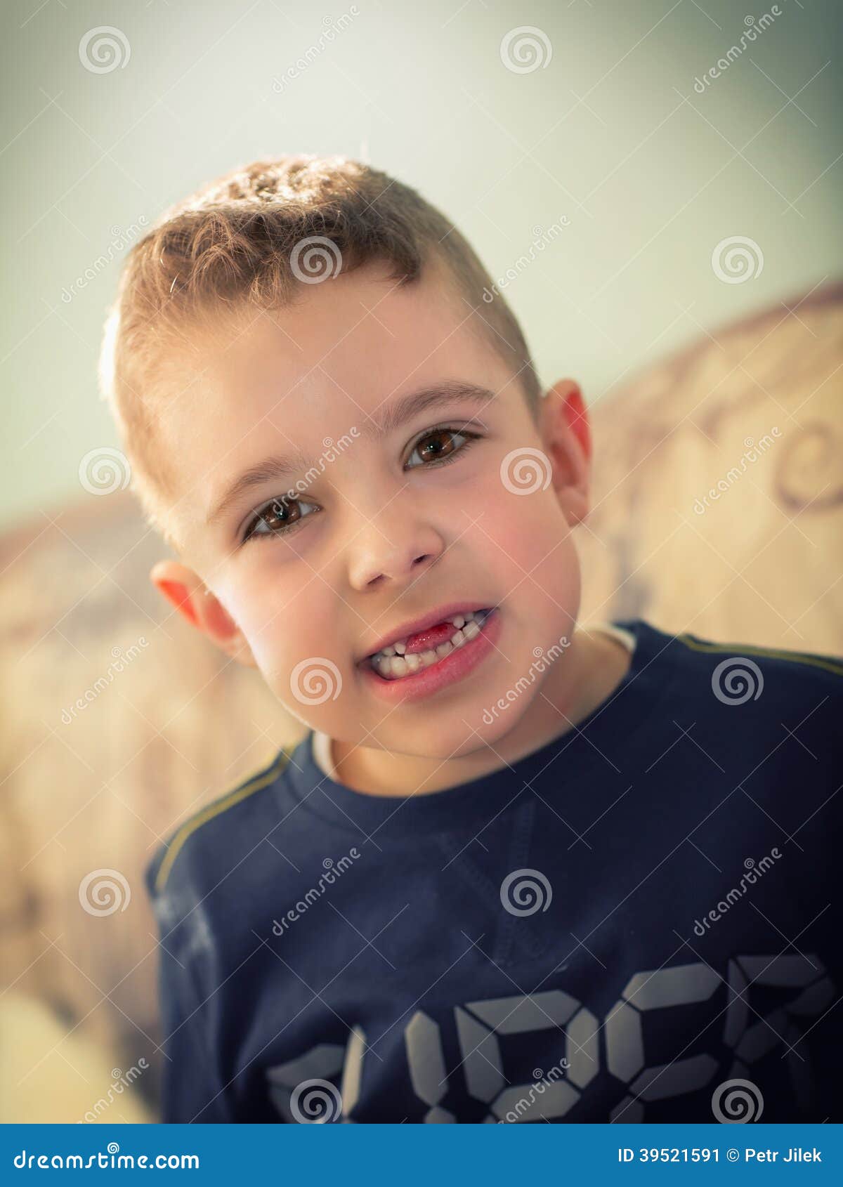 Little Boy Showing Missing Teeth Stock Image - Image of childhood, cute ...