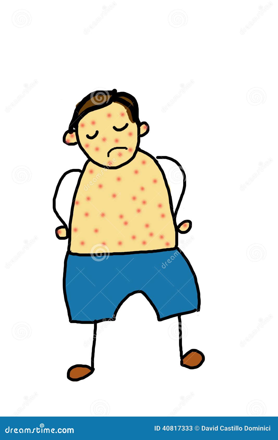Sick Boy With Chickenpox, Measles, Rubeola Or Skin Rash Vector ...
