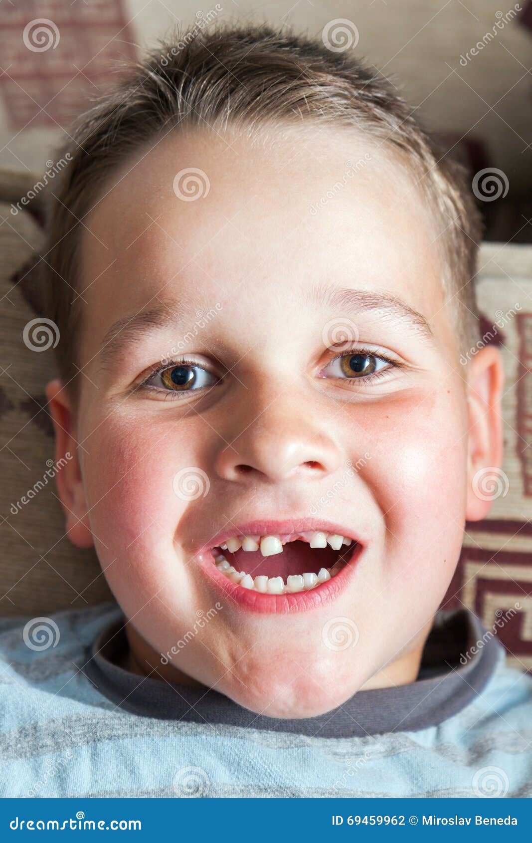 Little Boy with a Torn Front First Milk Tooth Stock Photo - Image of ...