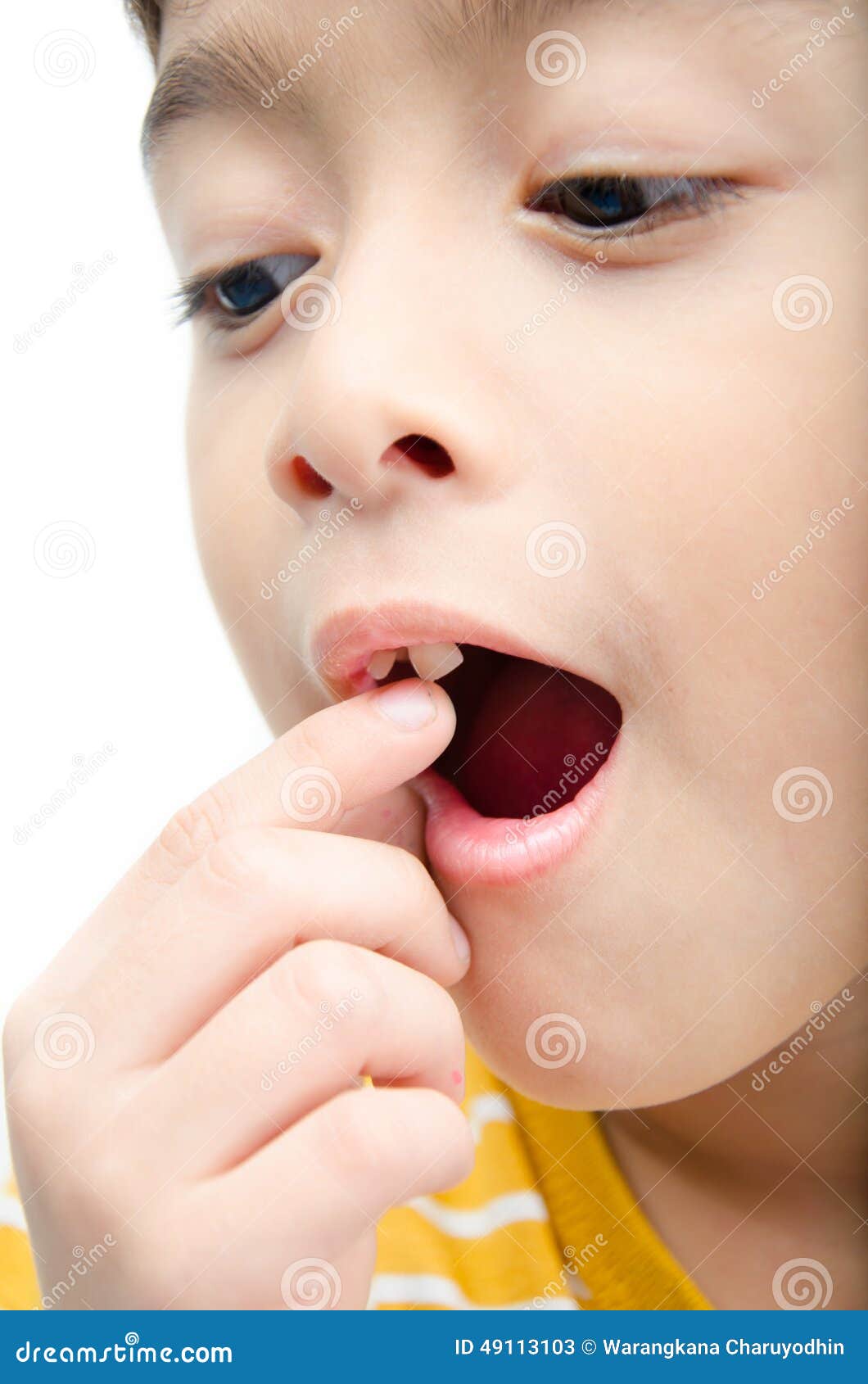 Little Boy Touching His Teeth Which Going Out Stock Image - Image of ...
