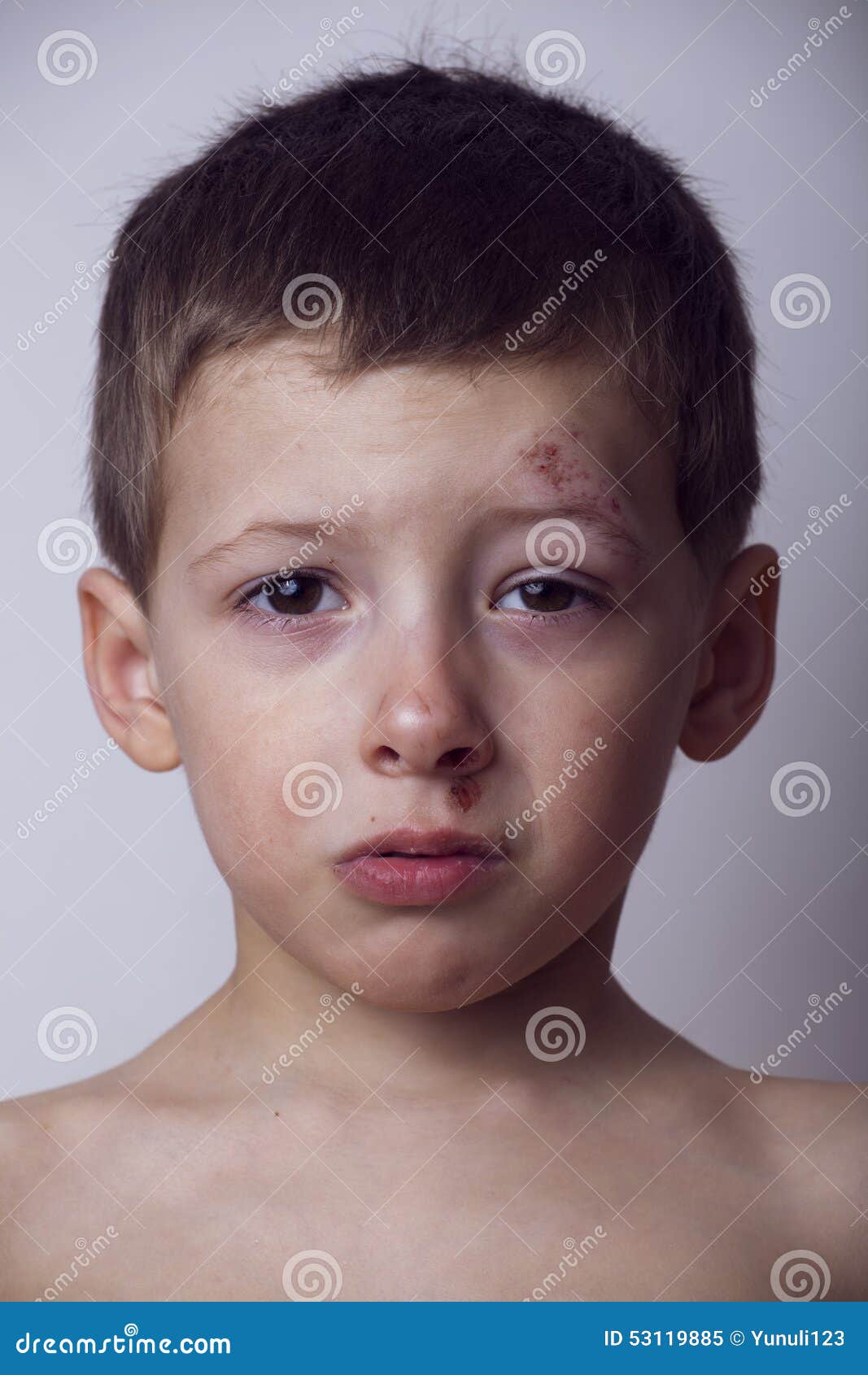 Little Boy Whipped Close Up, Isolated Stock Image - Image of bleed ...