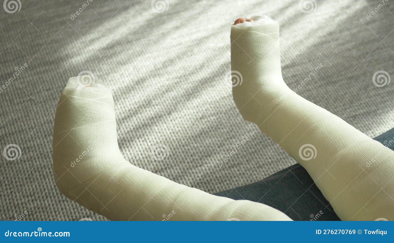Little Child with Plaster Bandage on Leg. Stock Video - Video of ...