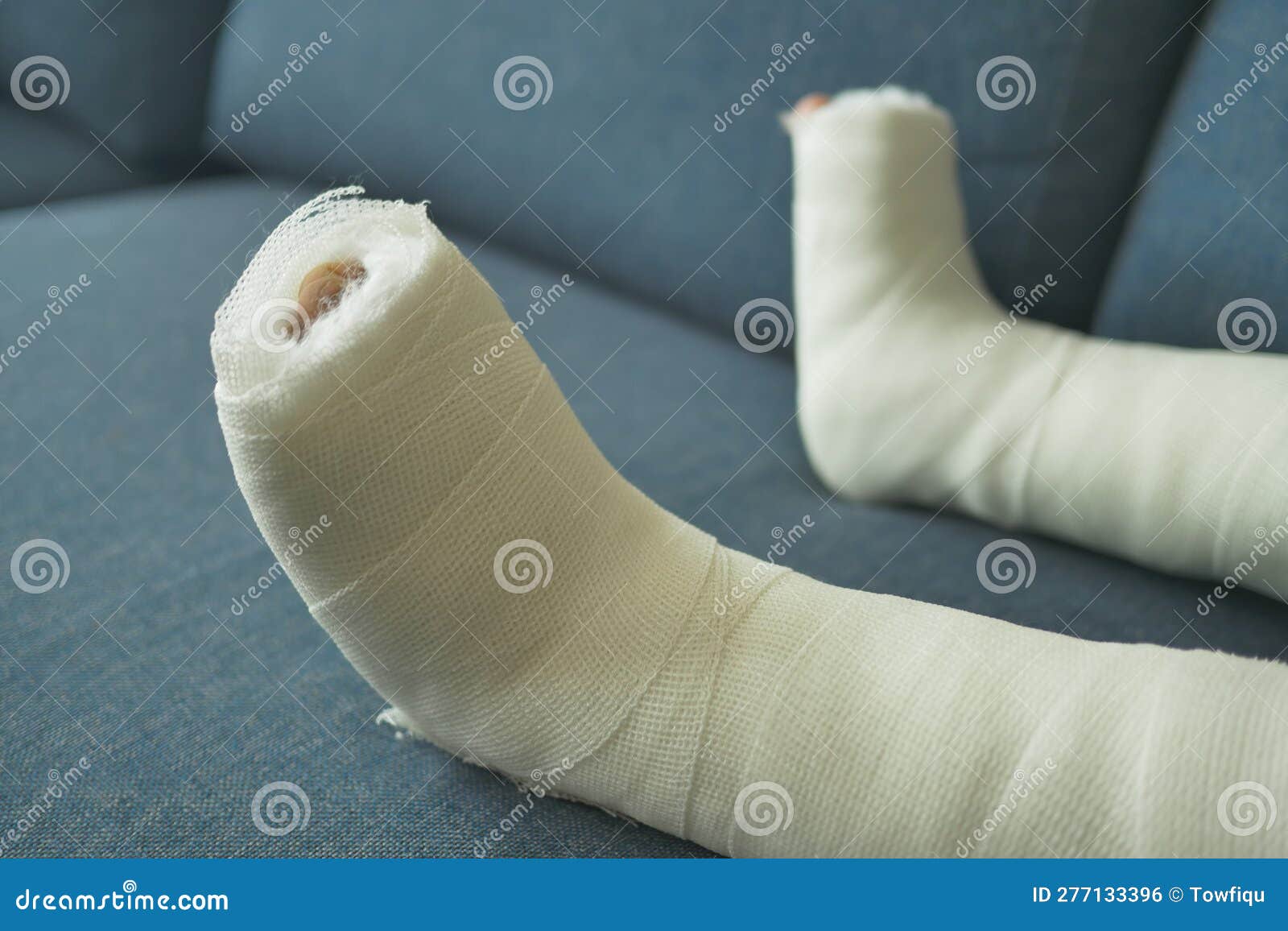 Little Child with Plaster Bandage on Leg. Stock Photo - Image of human ...