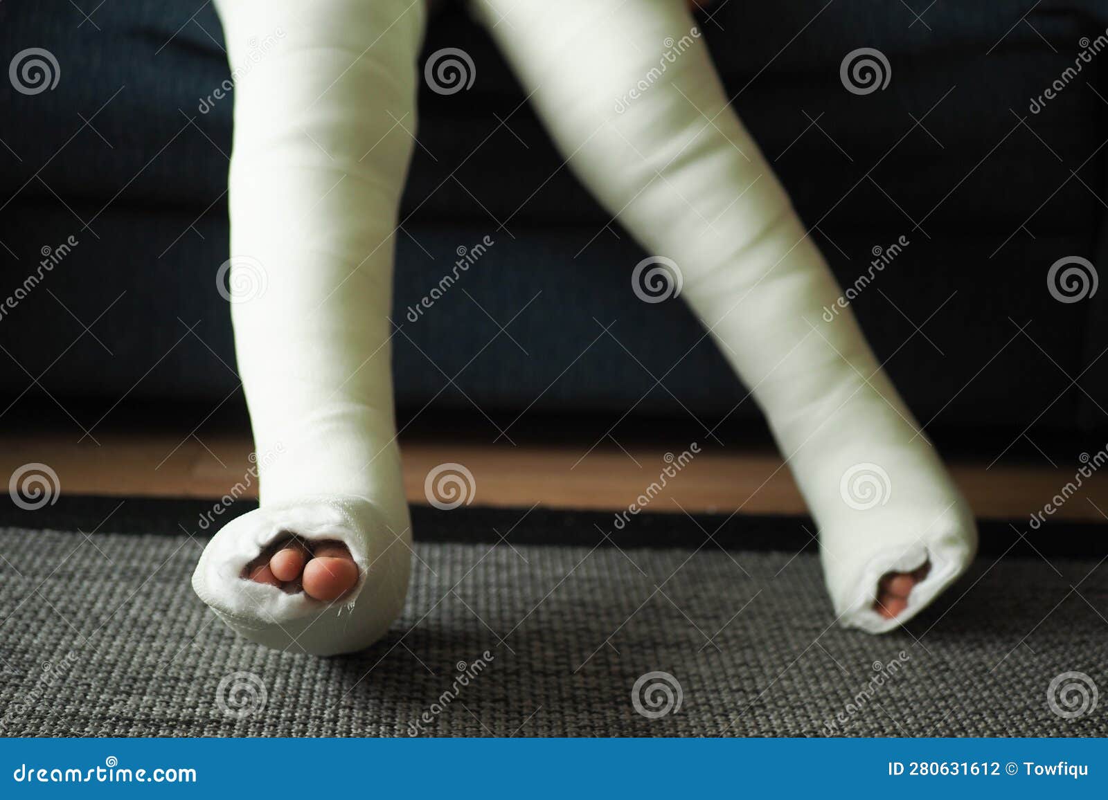 Little Child with Plaster Bandage on Leg. Stock Photo - Image of sprain ...