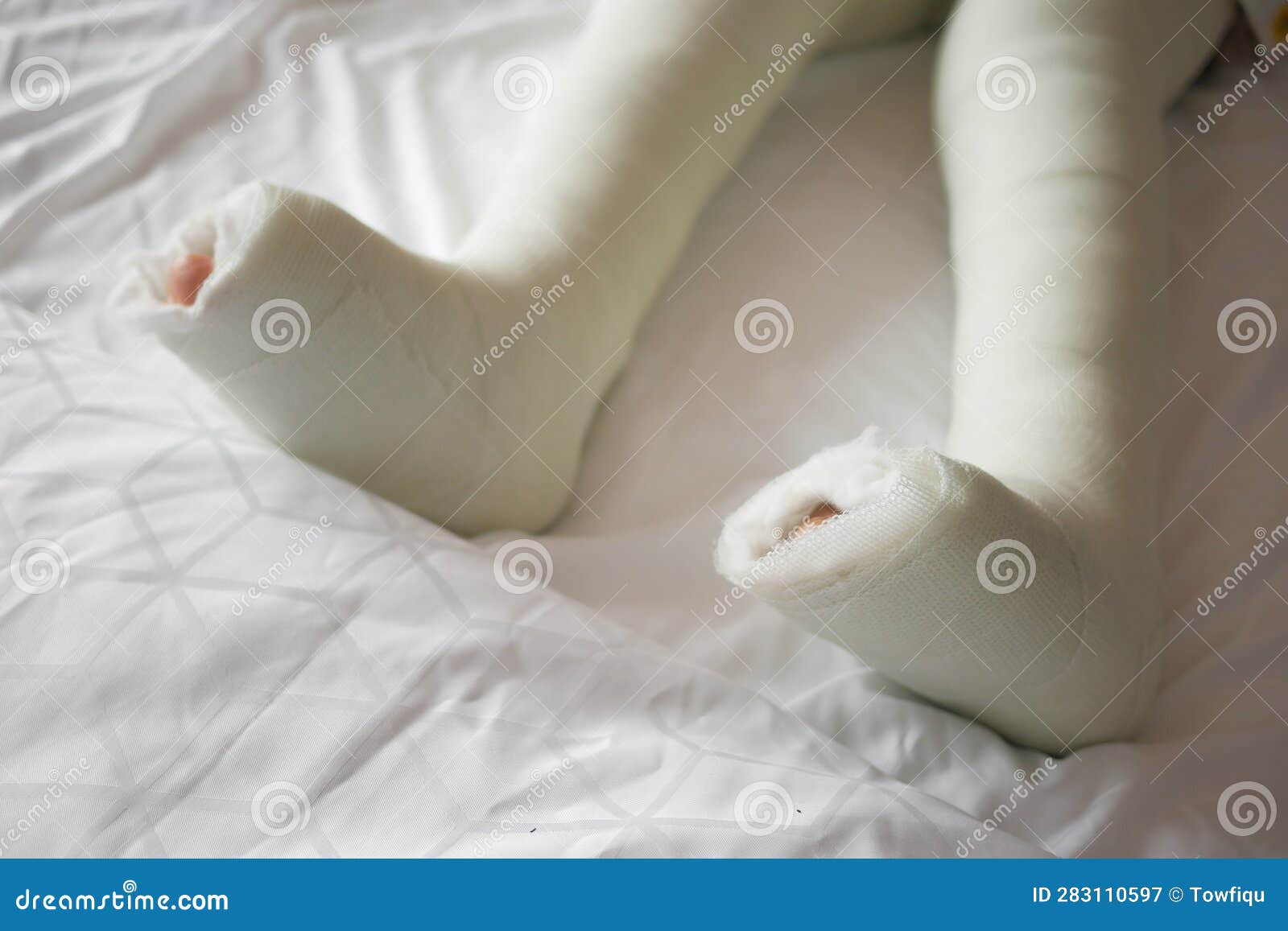 Little Child with Plaster Bandage on Leg. Stock Image - Image of foot ...