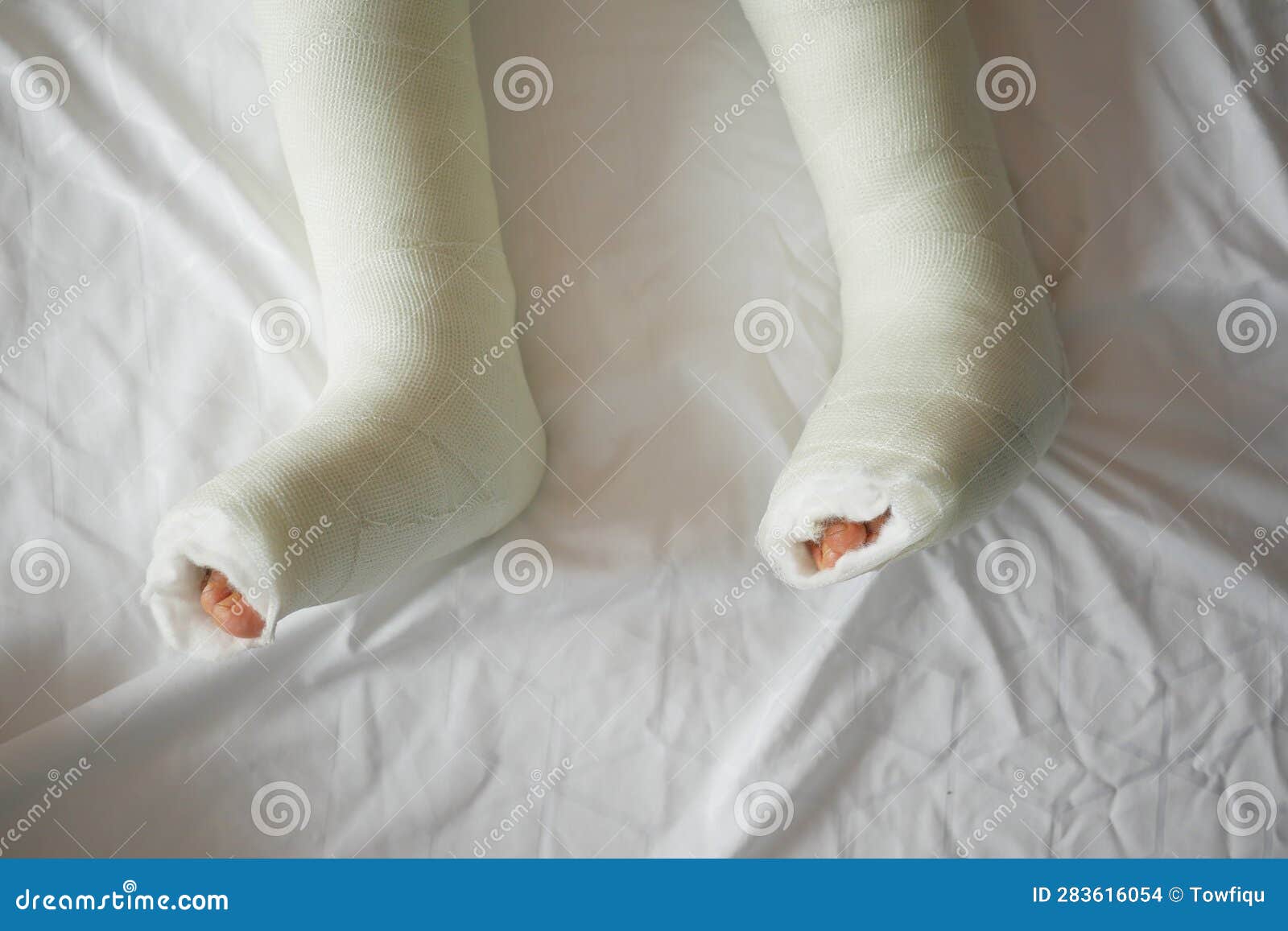 Little Child with Plaster Bandage on Leg. Stock Photo - Image of ...