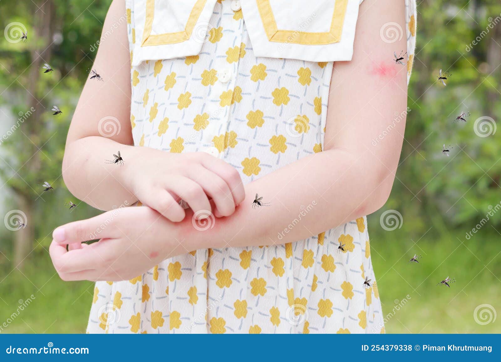 Little Girl Has Skin Rash Allergy Itching and Scratching on Her Arm ... Little Girl Has Skin Rash Allergy Itching and Scratching on Her Arm ...