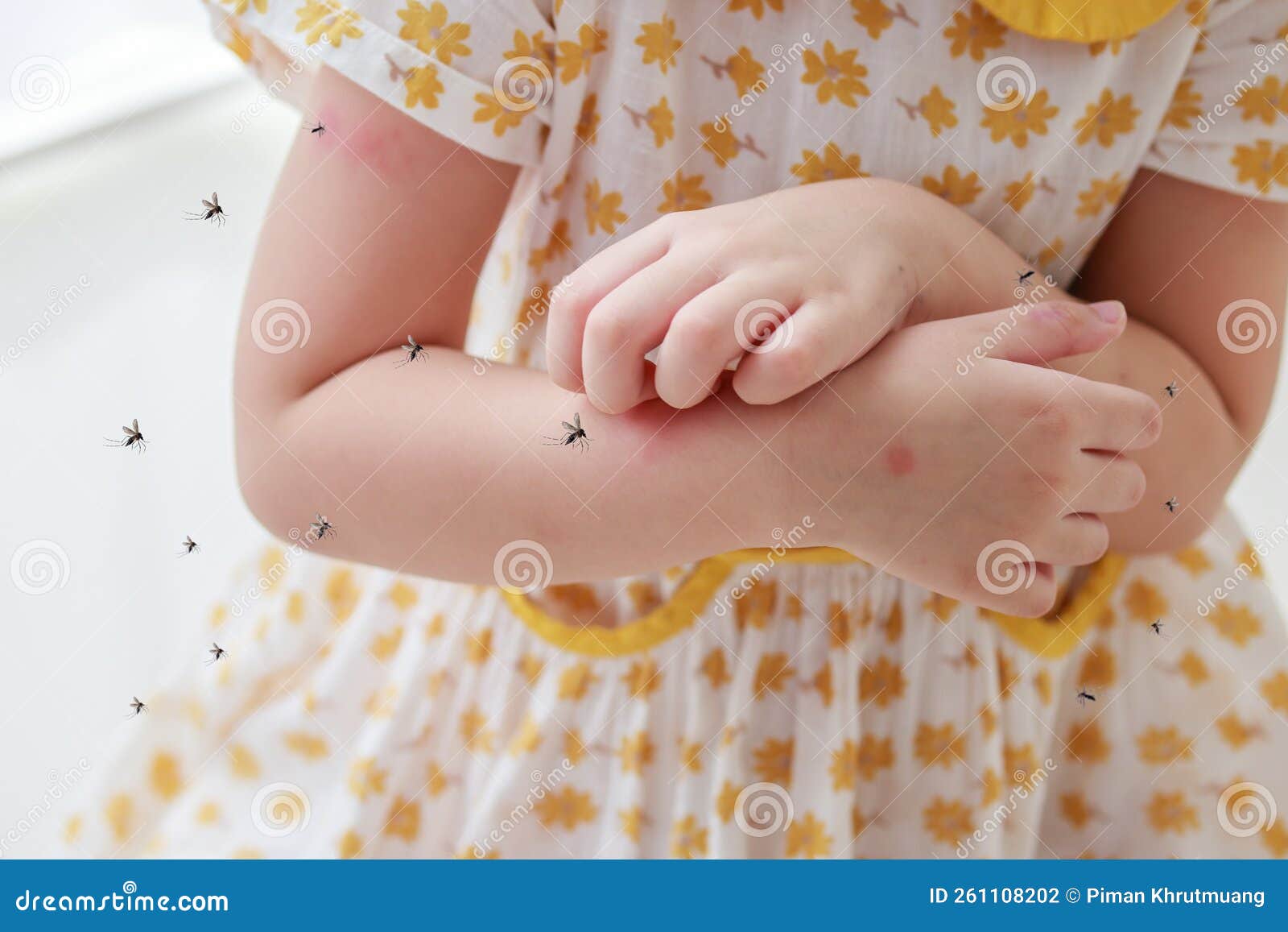 Little Girl Has Skin Rash Allergy and Itchy on Her Arm from Mosquito ... Little Girl Has Skin Rash Allergy and Itchy on Her Arm from Mosquito ...