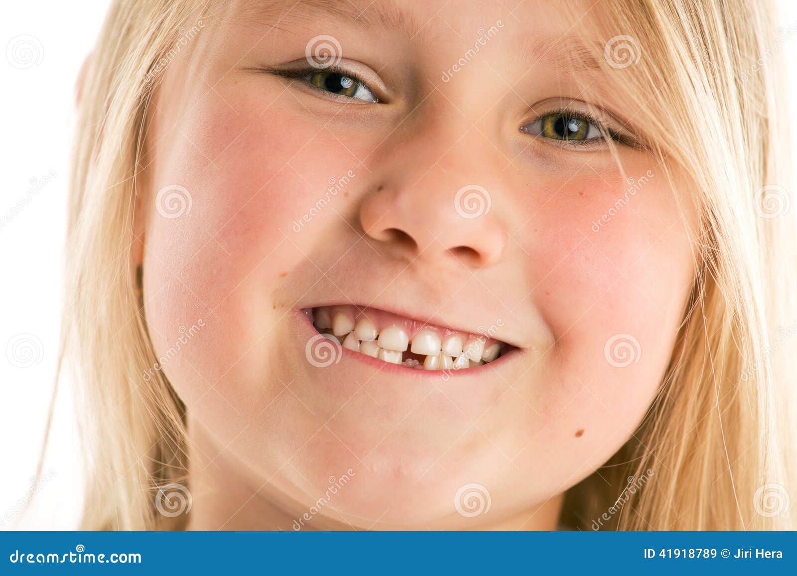 Little Girl with Missing Teeth Stock Image - Image of closeup, hole ...