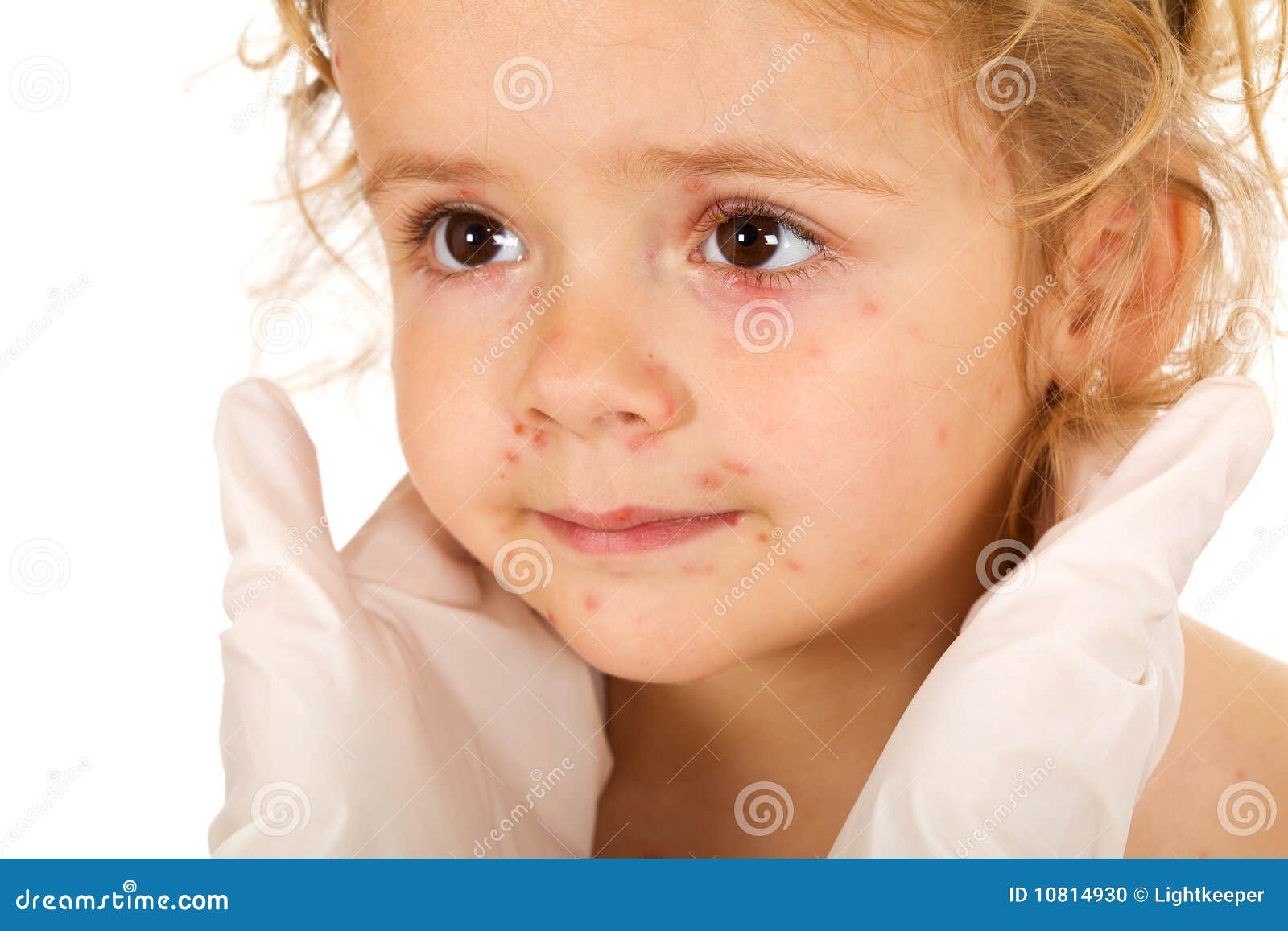 272 Hospital Patient Pox Stock Photos - Free & Royalty-Free Stock ...