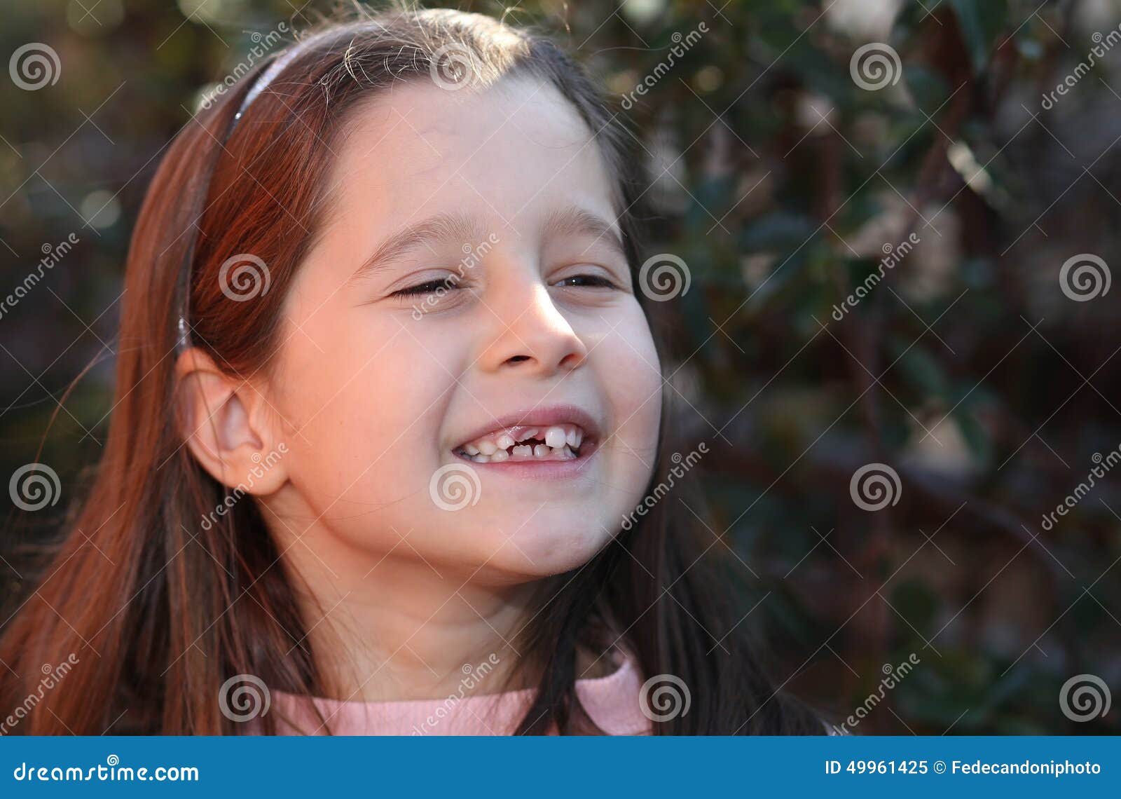 Little Girl without a Tooth while Smiling Stock Image - Image of ...